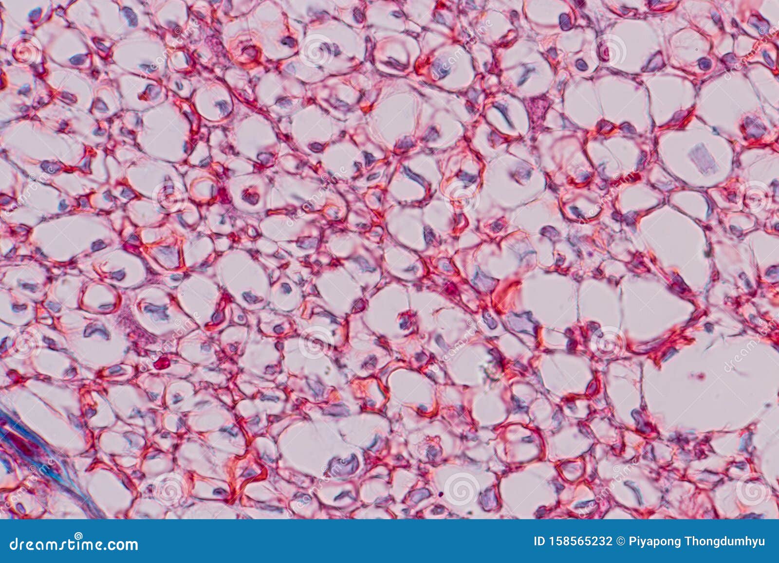 Nerve Human Under the Microscope. Stock Photo - Image of nerve, micro ...