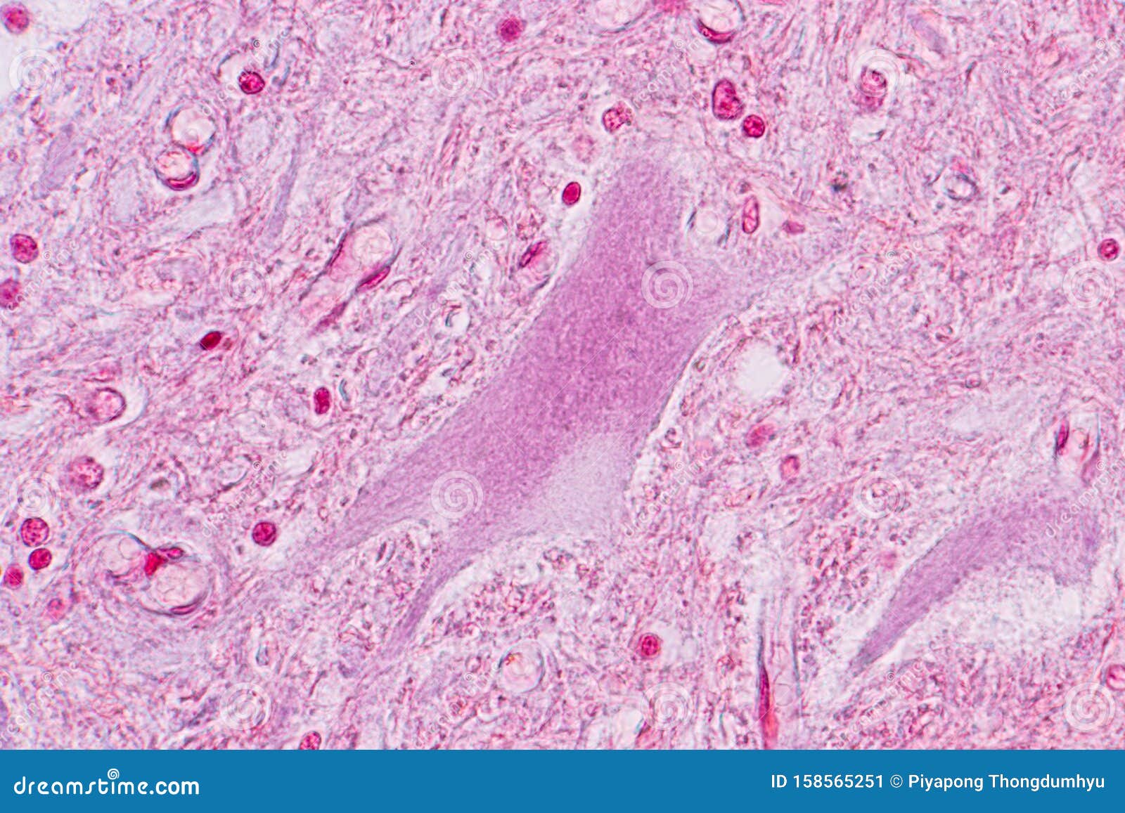Nerve Human Under the Microscope. Stock Image - Image of brain ...
