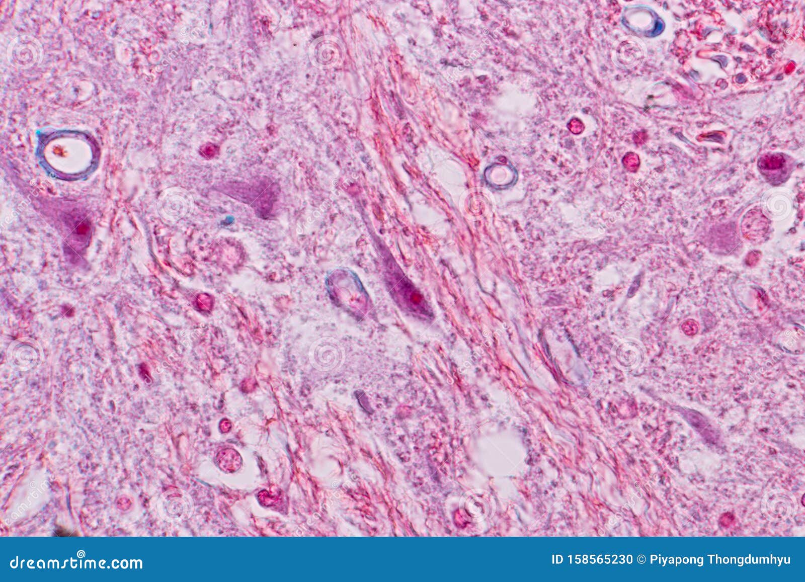 Nerve Human Under the Microscope. Stock Photo - Image of education ...