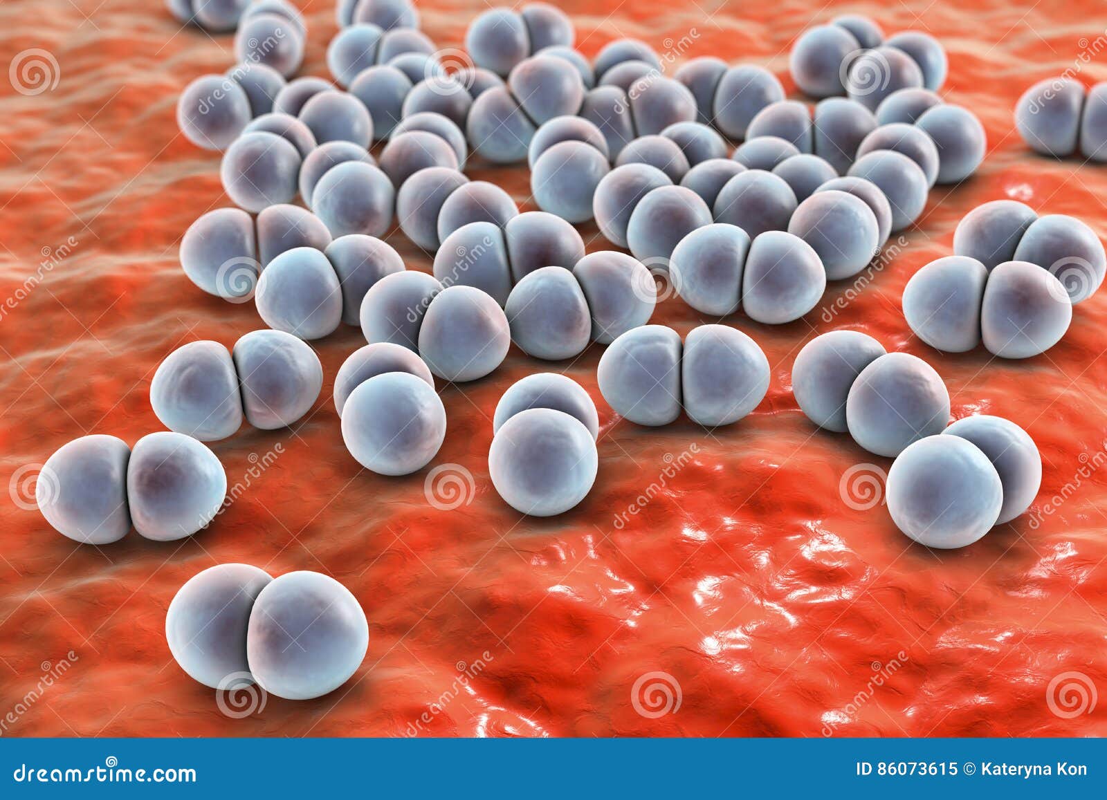 Neumococos De Las Bacterias, Estreptococo Pneumoniae Stock de ...