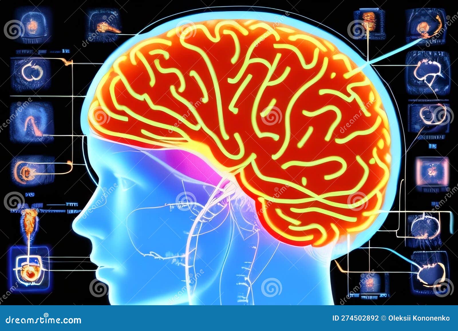Neural Networks in the Human Brain. Electronic Impulses in the Head ...