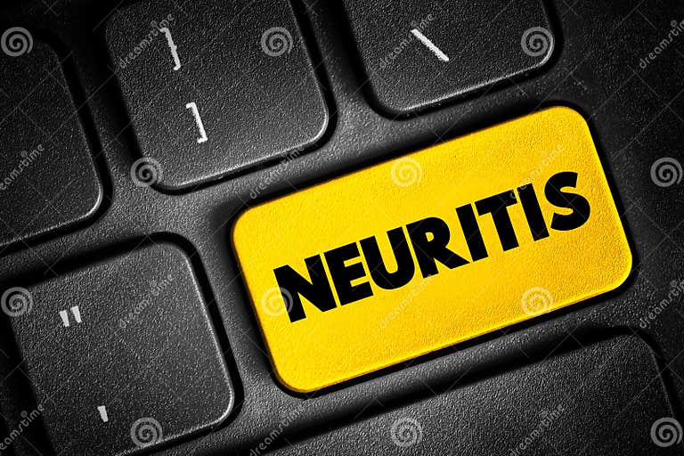 Neuritis - Inflammation of a Nerve or the General Inflammation of the ...