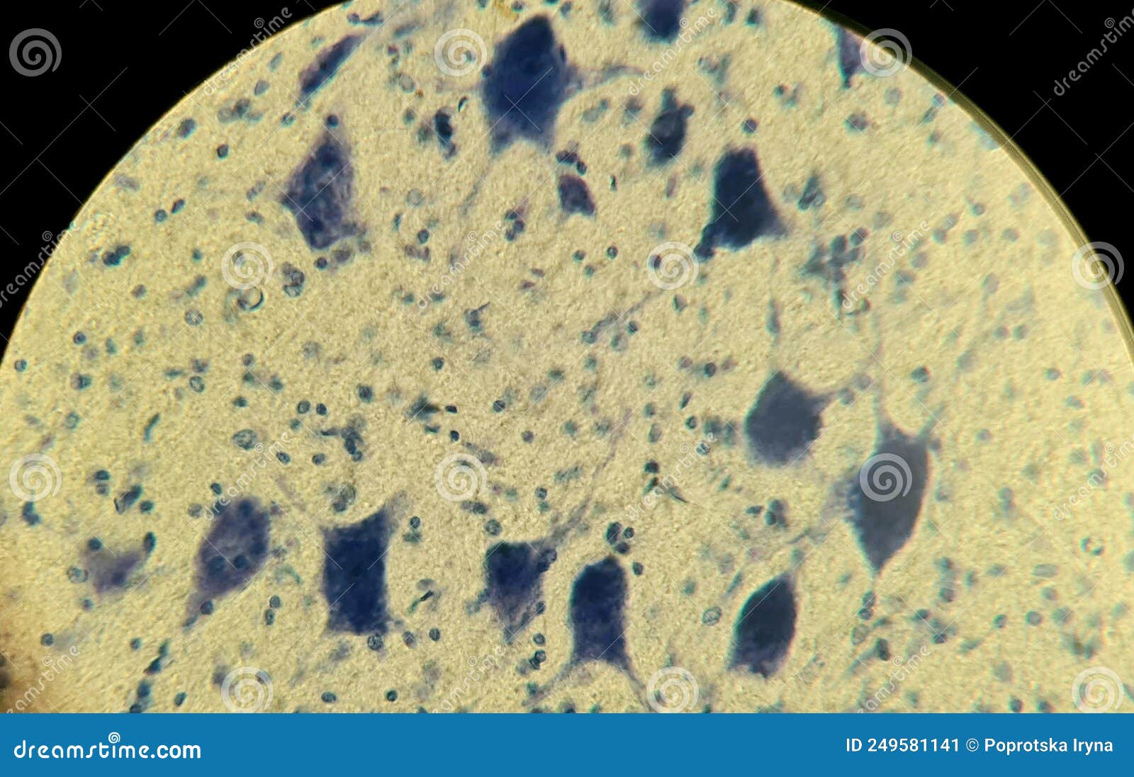 Neurocytes with Processes. Cell Structure of Nervous Tissue Stock Image ...
