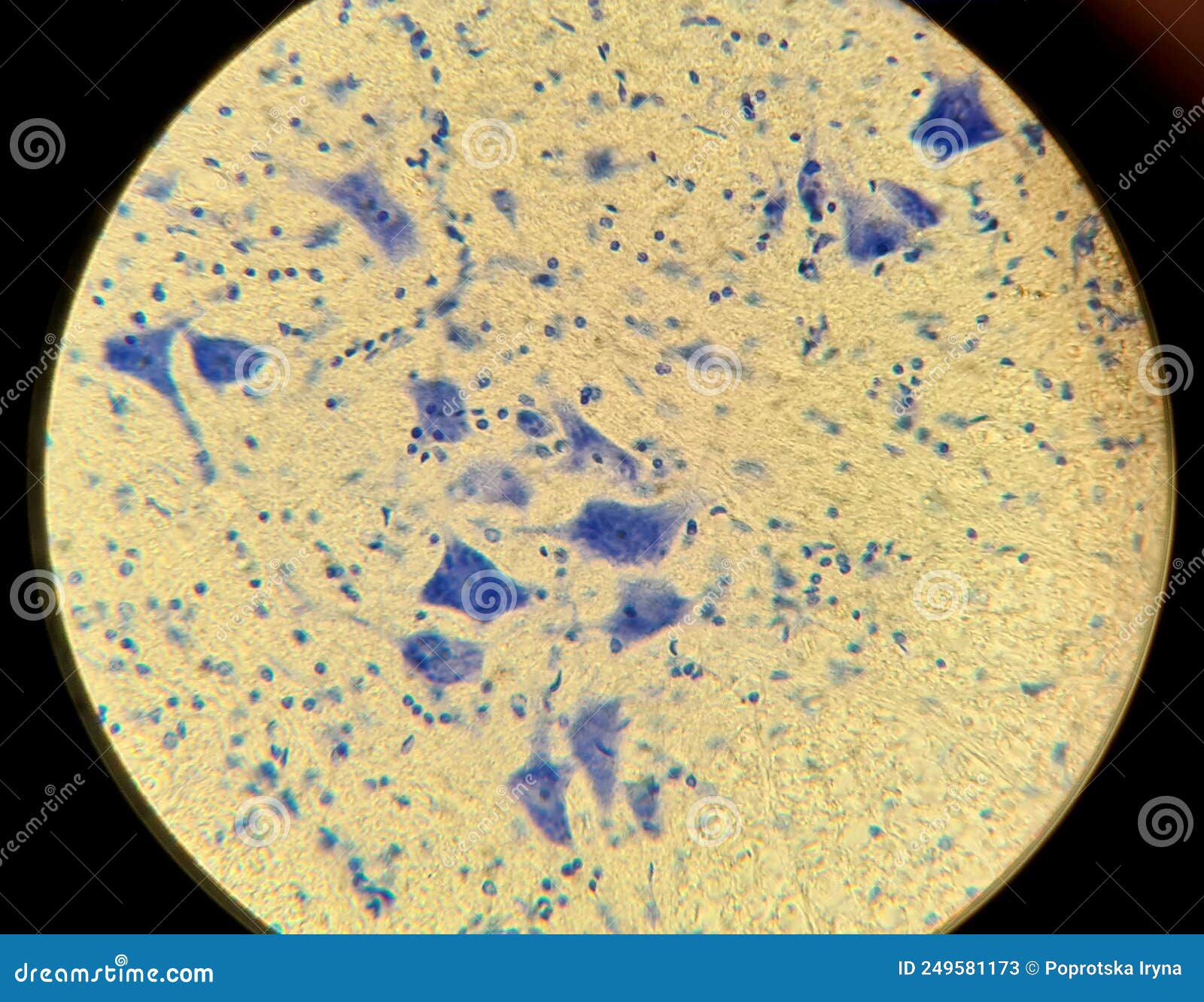 Neurocytes with Processes. Cell Structure of Nervous Tissue Stock Image ...