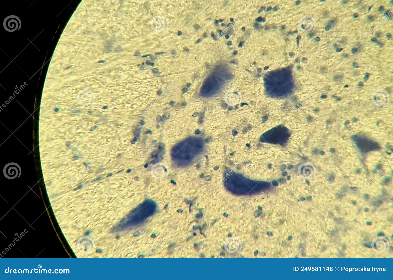 Neurocytes With Processes. Cell Structure Of Nervous Tissue Stock Photo ...