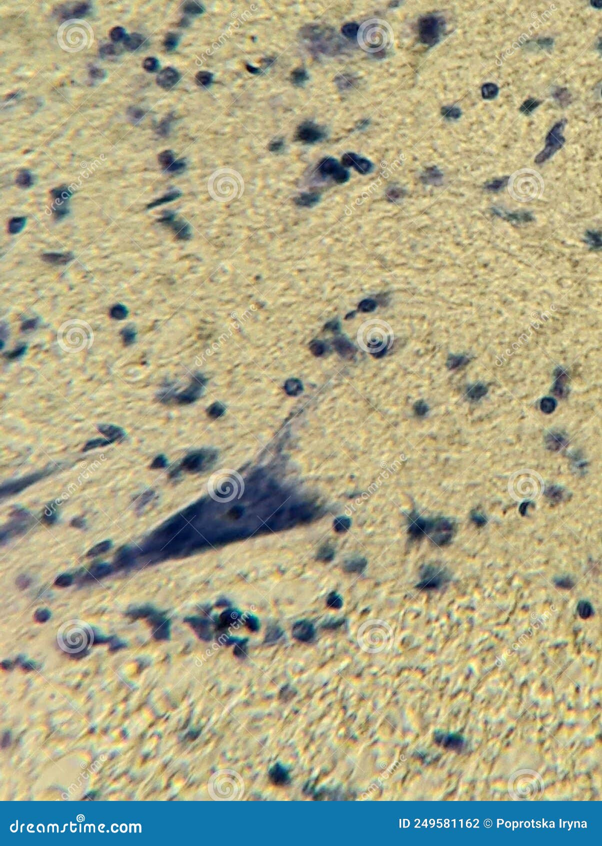 Neurocytes With Processes. Cell Structure Of Nervous Tissue Stock Image ...