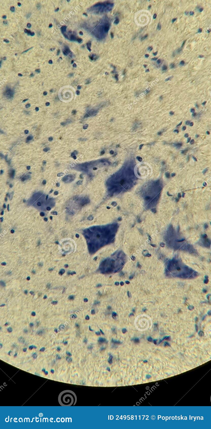 Nervous Tissue Under A Microscope Royalty-Free Stock Photography ...