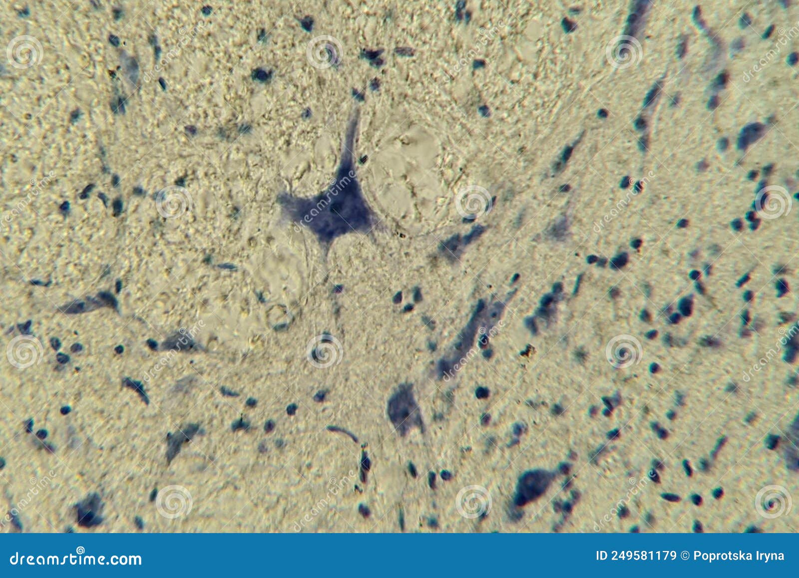 Neurocytes With Processes. Cell Structure Of Nervous Tissue Stock Photo ...