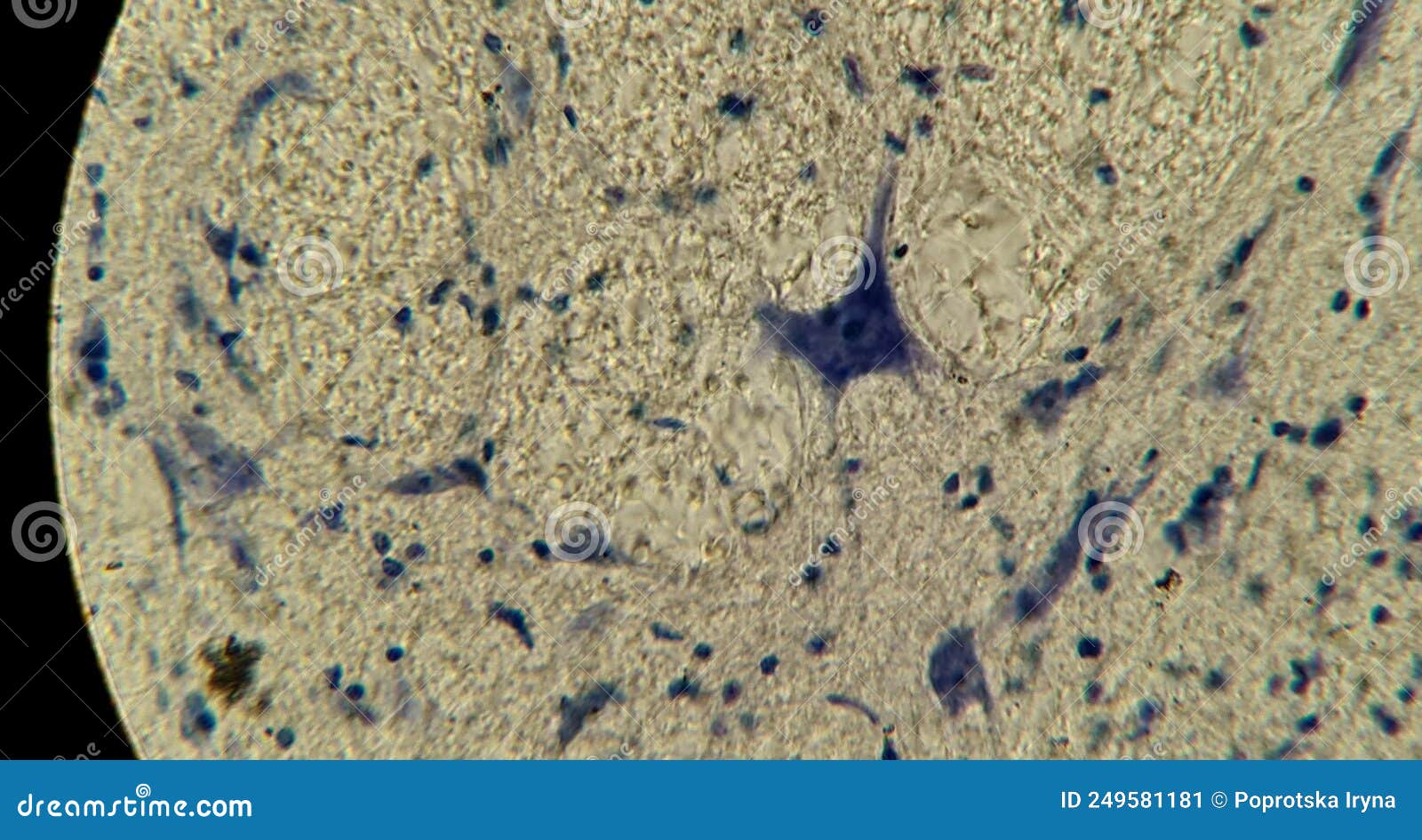 Neurocytes With Processes. Cell Structure Of Nervous Tissue Royalty ...