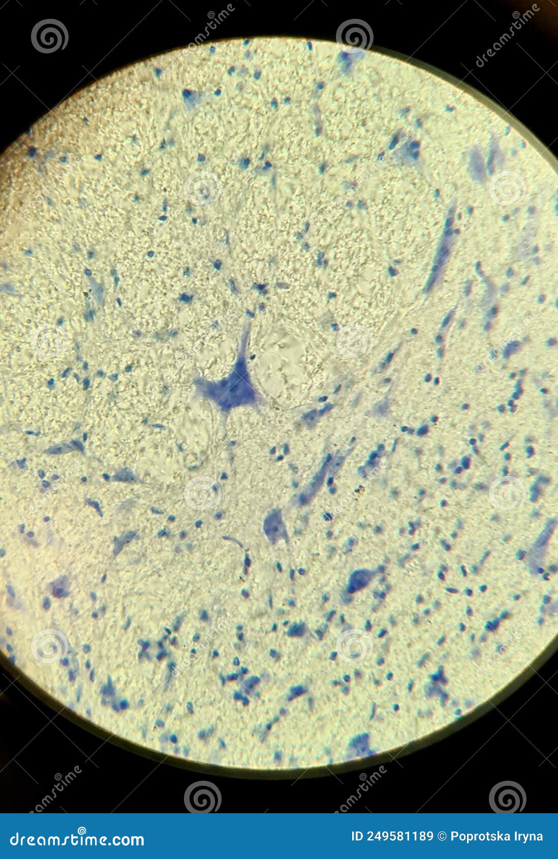 Neurocytes With Processes. Cell Structure Of Nervous Tissue Royalty ...