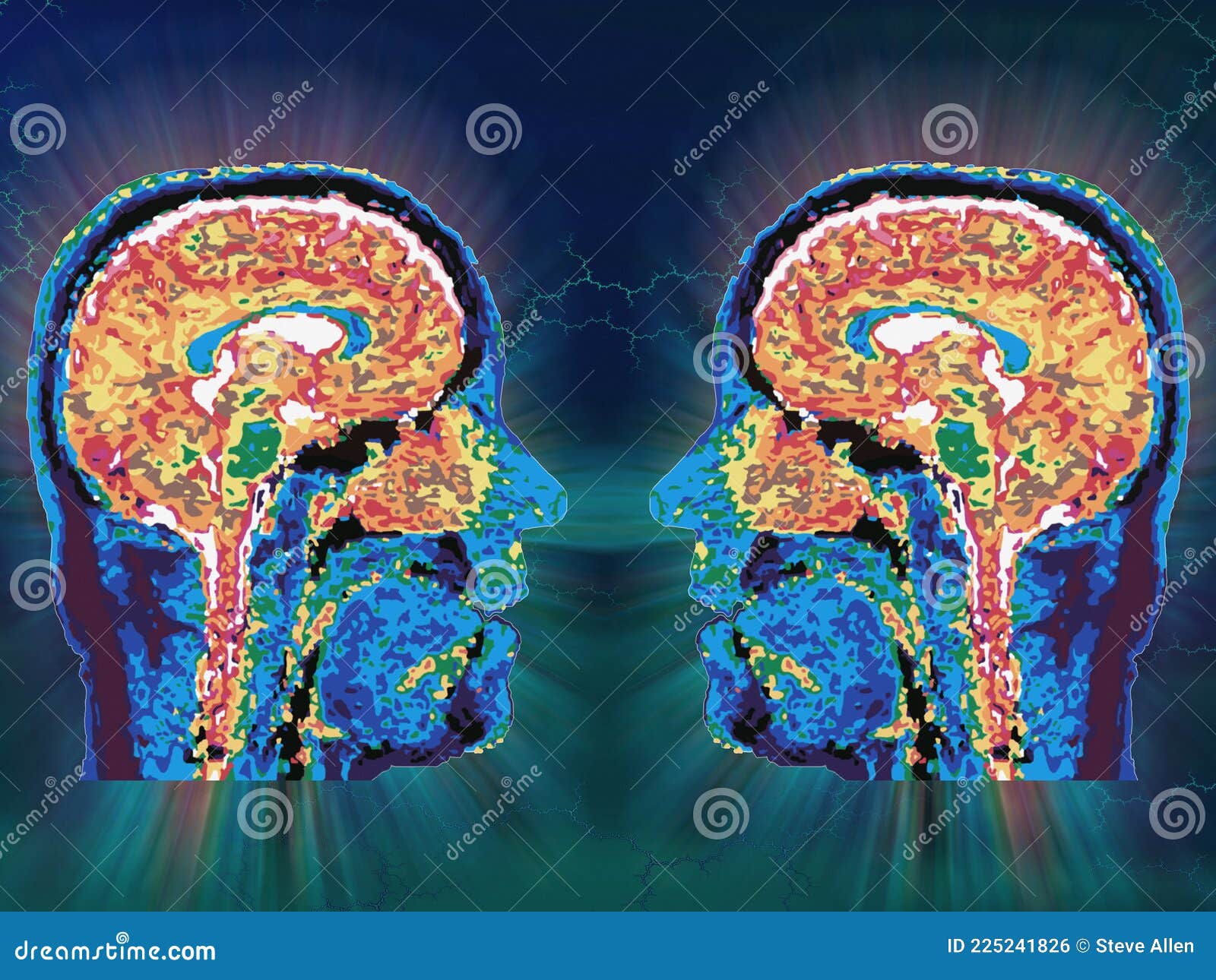 Neuroimaging or Brain Imaging Stock Illustration - Illustration of ...