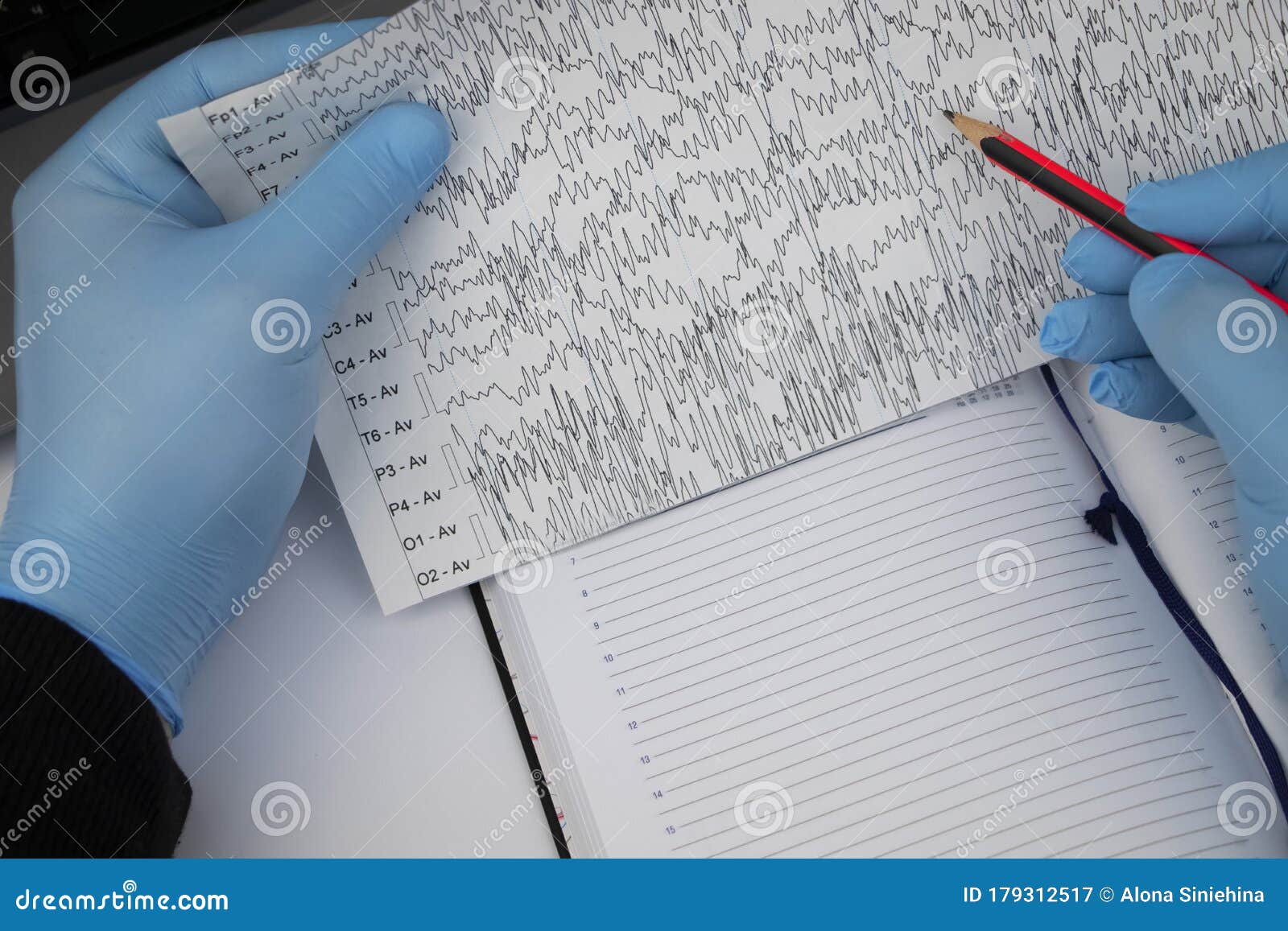 A Neurologist Examines an Encephalogram of a Patientâ€™s Brain ...