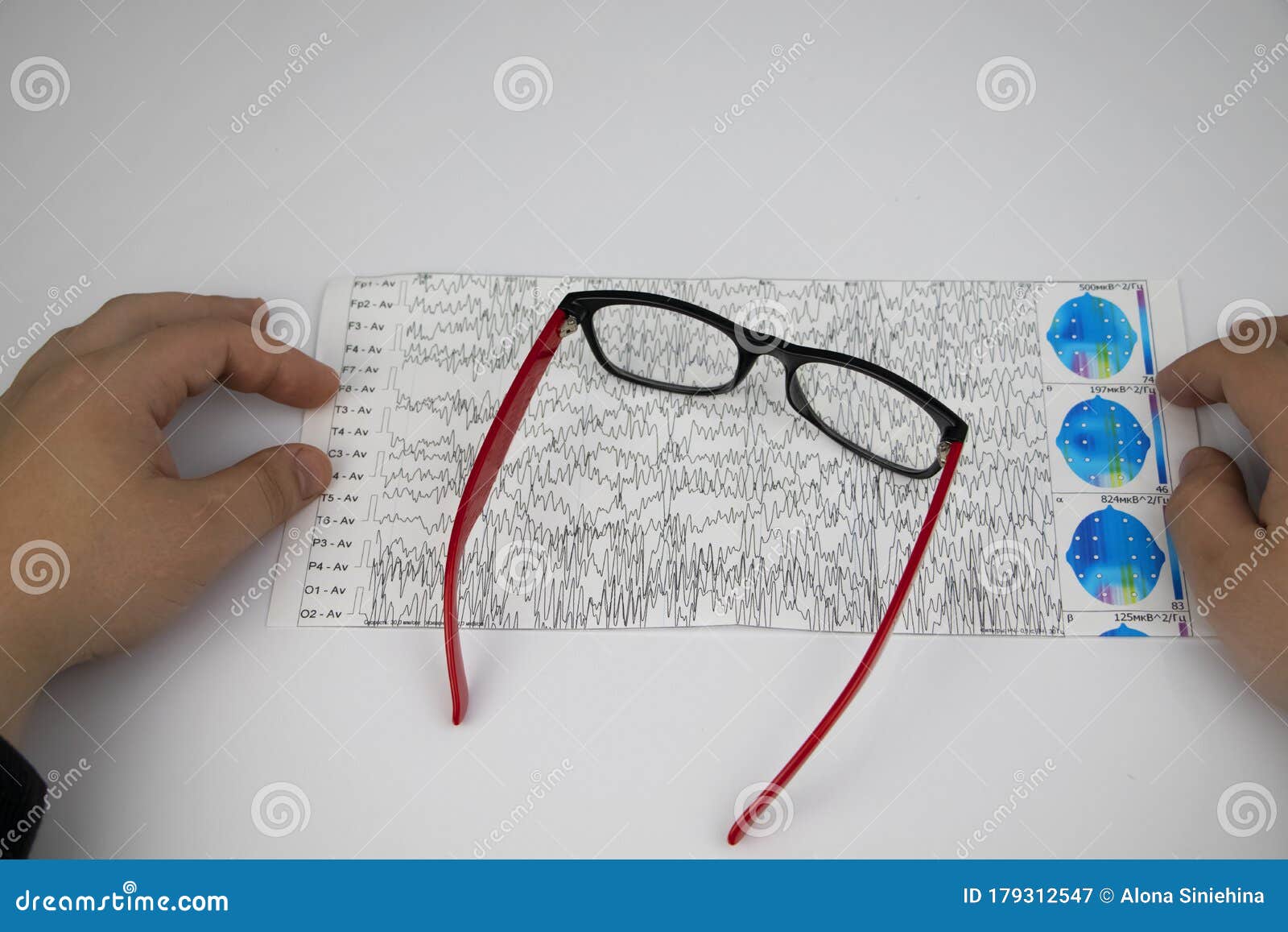 A Neurologist Examines an Encephalogram of a Patientâ€™s Brain ...