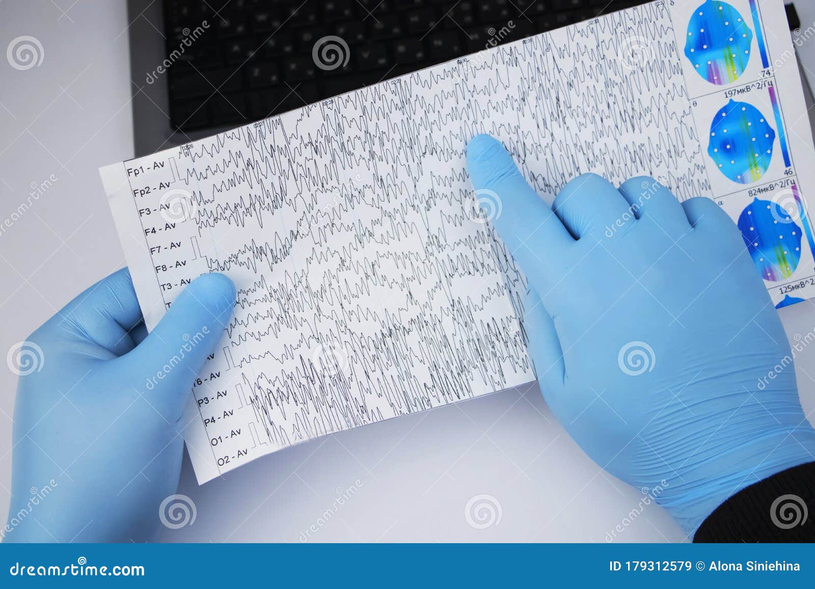 A Neurologist Examines An Encephalogram Of A Patientâ€™s Brain ...