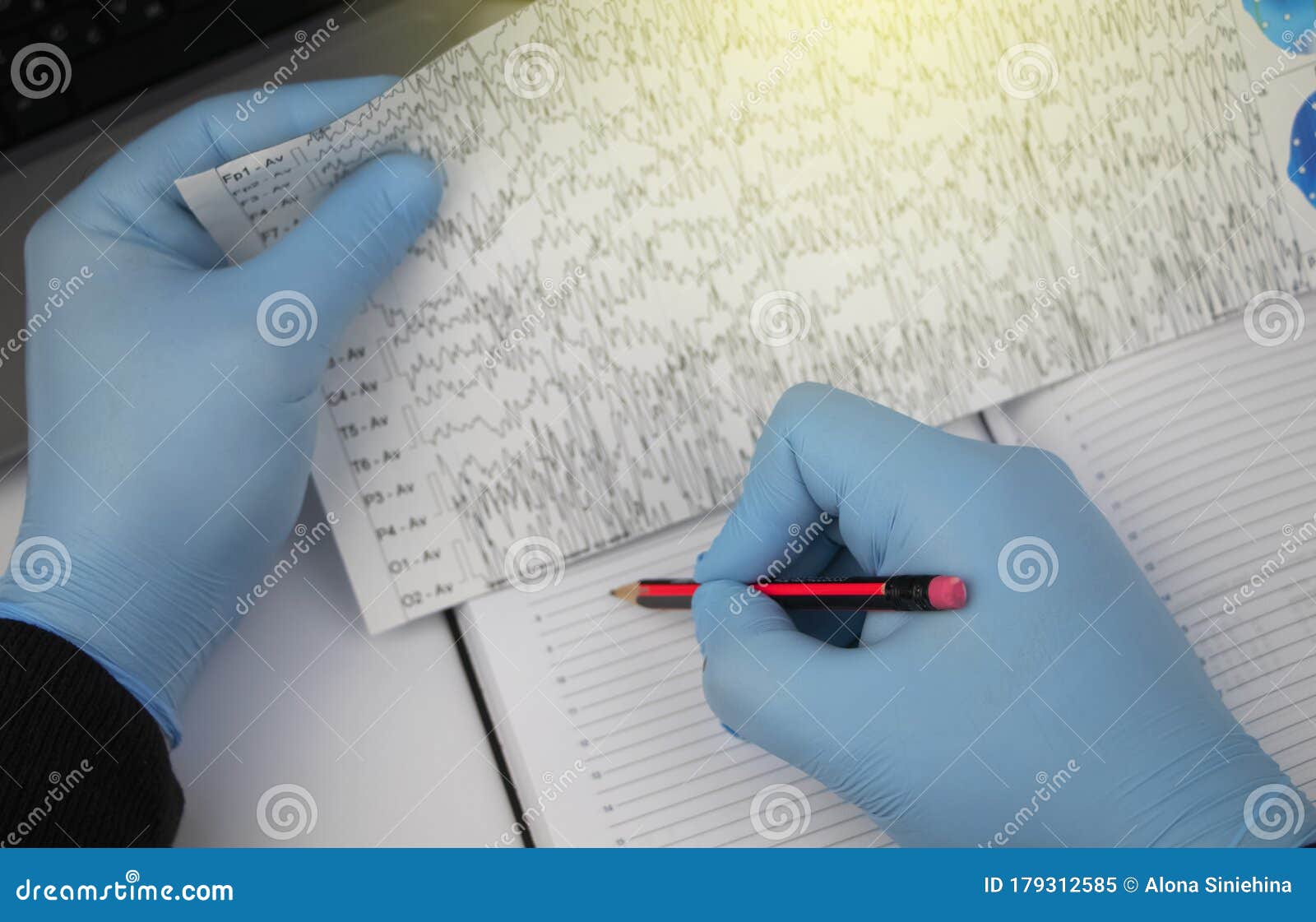 A Neurologist Examines an Encephalogram of a Patient’s Brain. Schedule ...