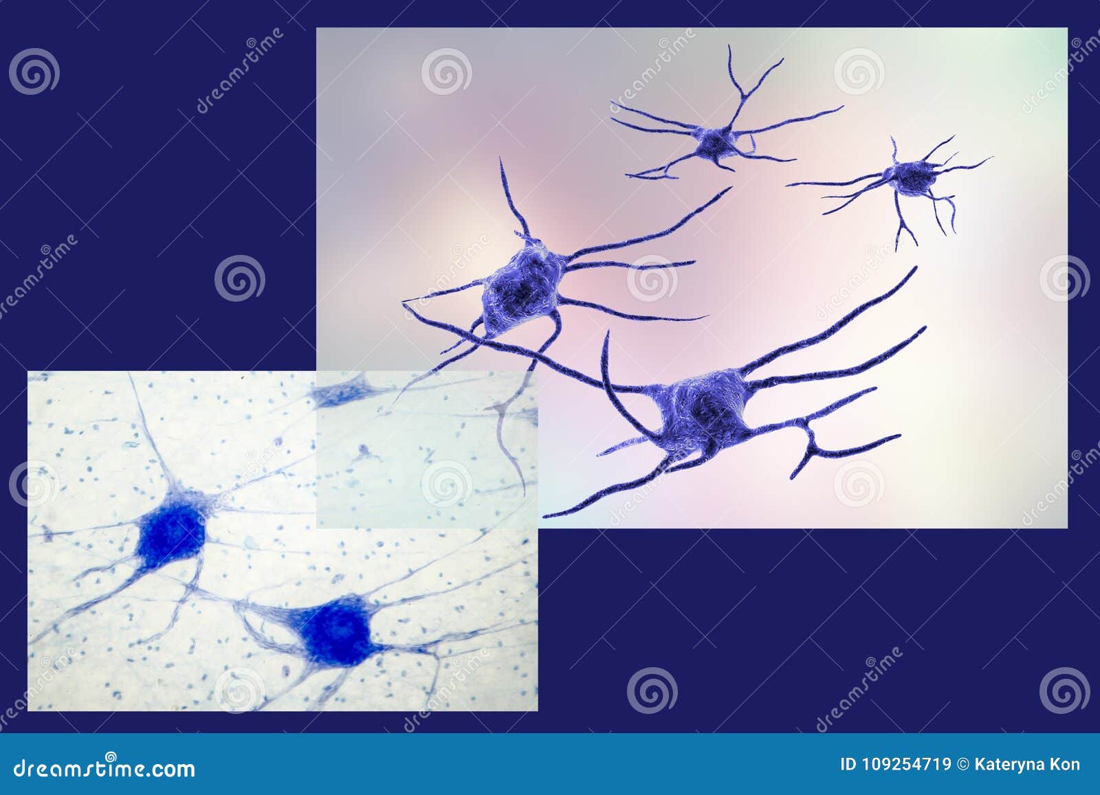 Human Brain Cells Under A Microscope