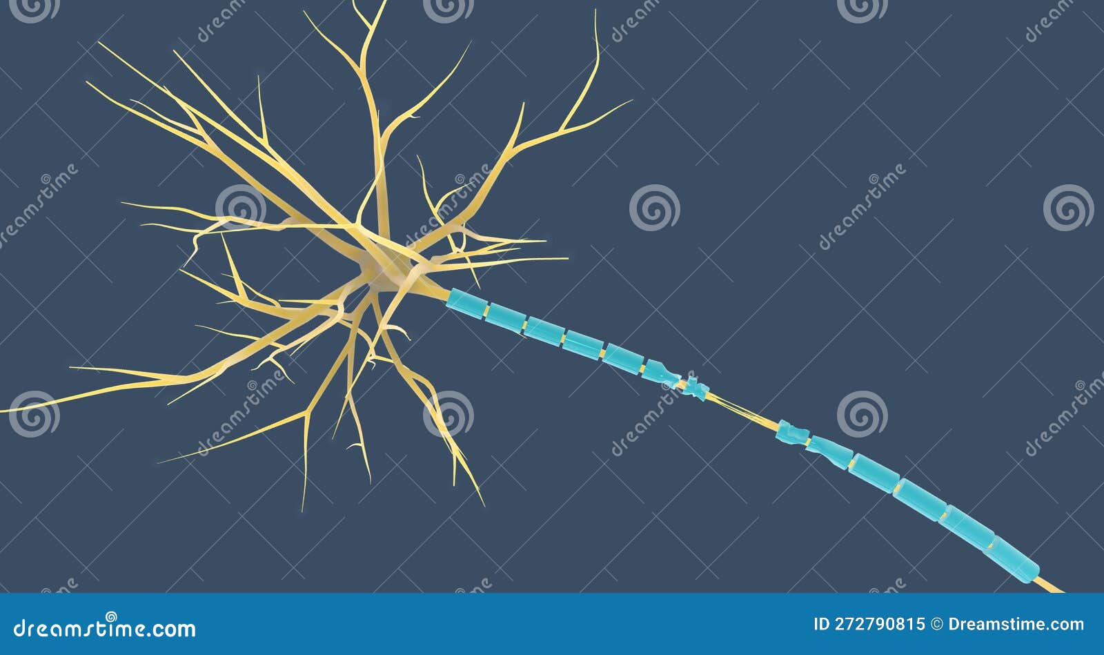 The Neuron Damage in Concussion Stock Illustration - Illustration of ...
