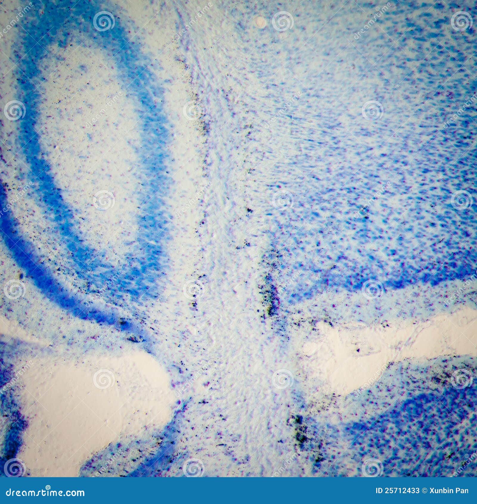 Neuronas Hippocampal Del Cerebro De La Rata Imagen de archivo - Imagen ...