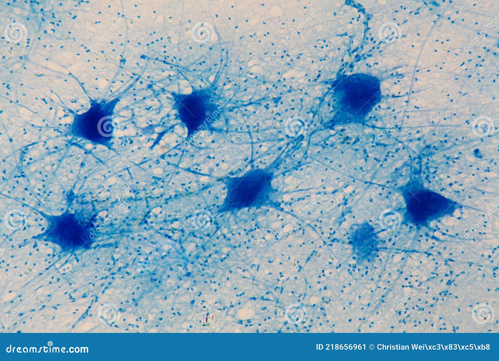 Neuronas Motoras Bajo El Microscopio Imagen de archivo - Imagen de ...