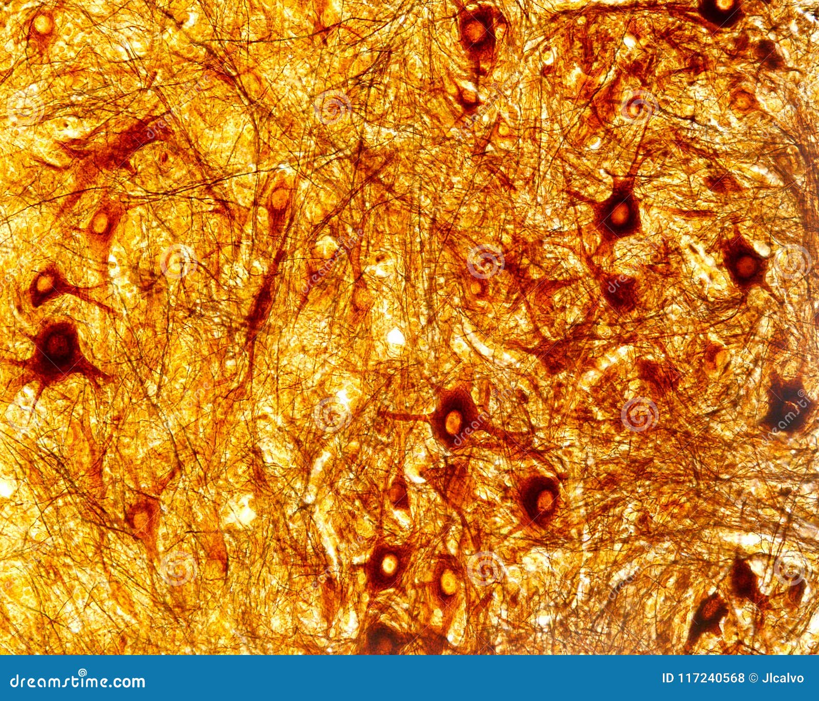 Neuronas Multipolares Médula Espinal Foto de archivo - Imagen de ...