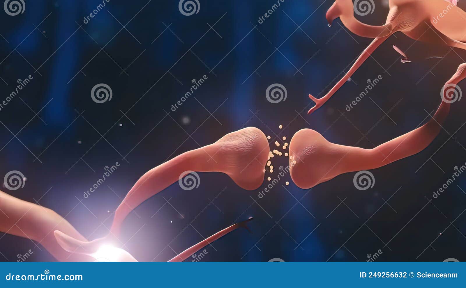 Neurons with Amyloid Plaques Stock Illustration - Illustration of head ...