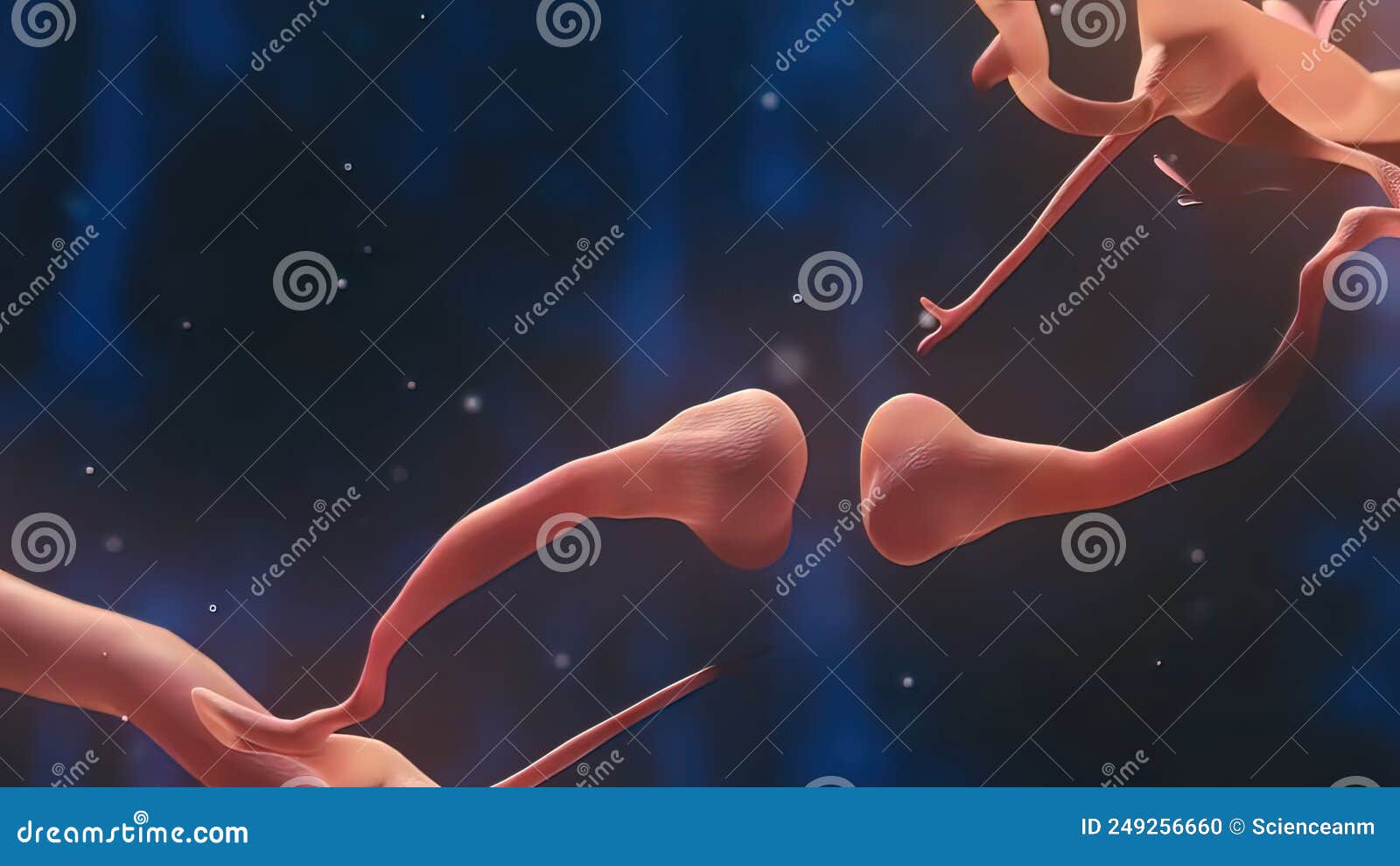 Neurons with Amyloid Plaques Stock Illustration - Illustration of ...