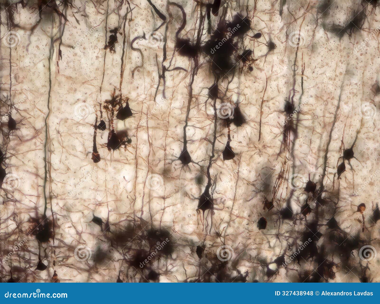 Golgi stain, brain stock photo. Image of branch, visualized - 327438948