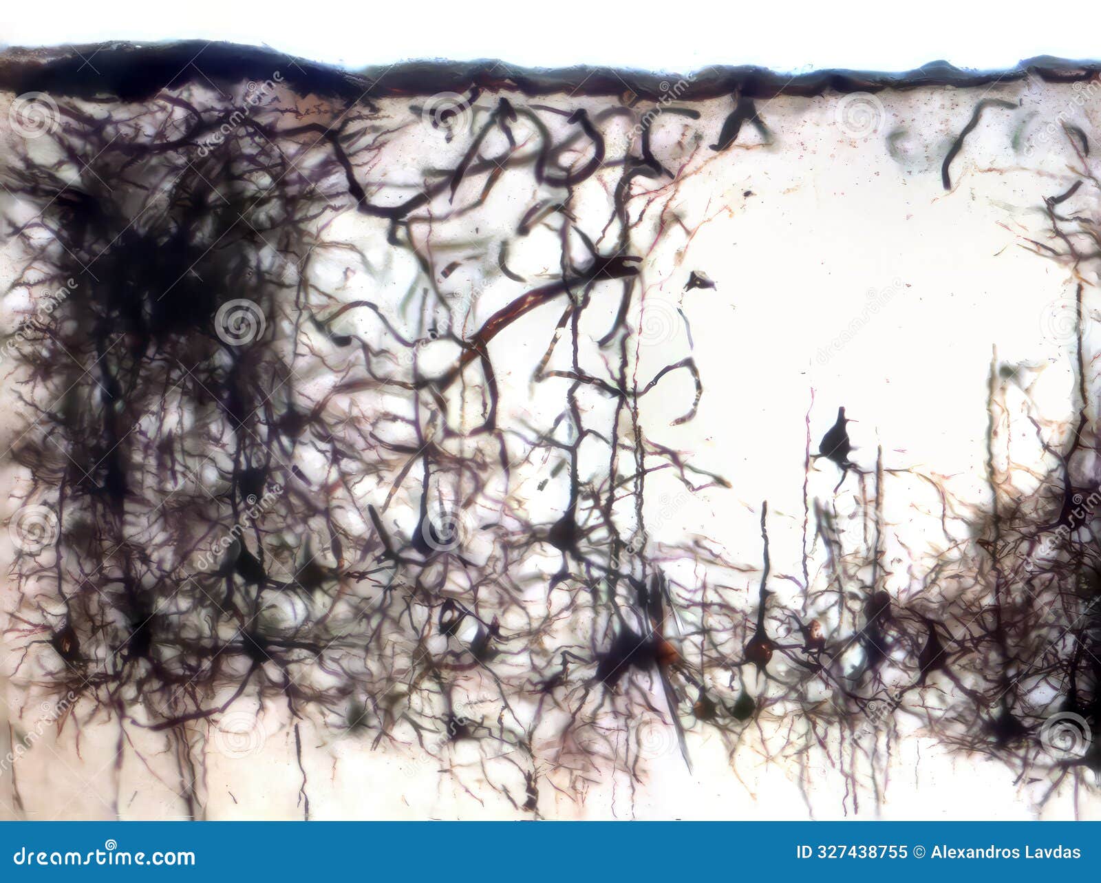 Golgi stain, brain stock image. Image of microscope - 327438755