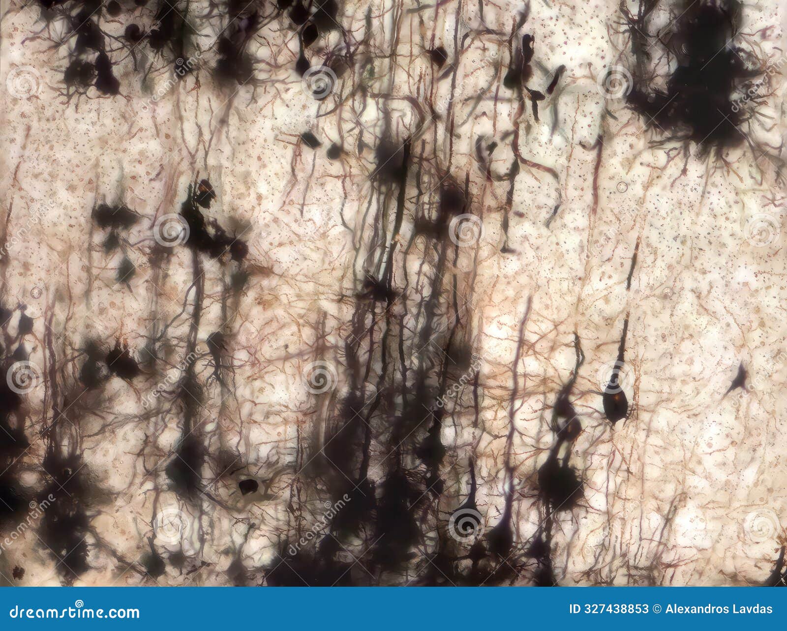 Golgi stain, brain stock image. Image of vessel, blood - 327438853