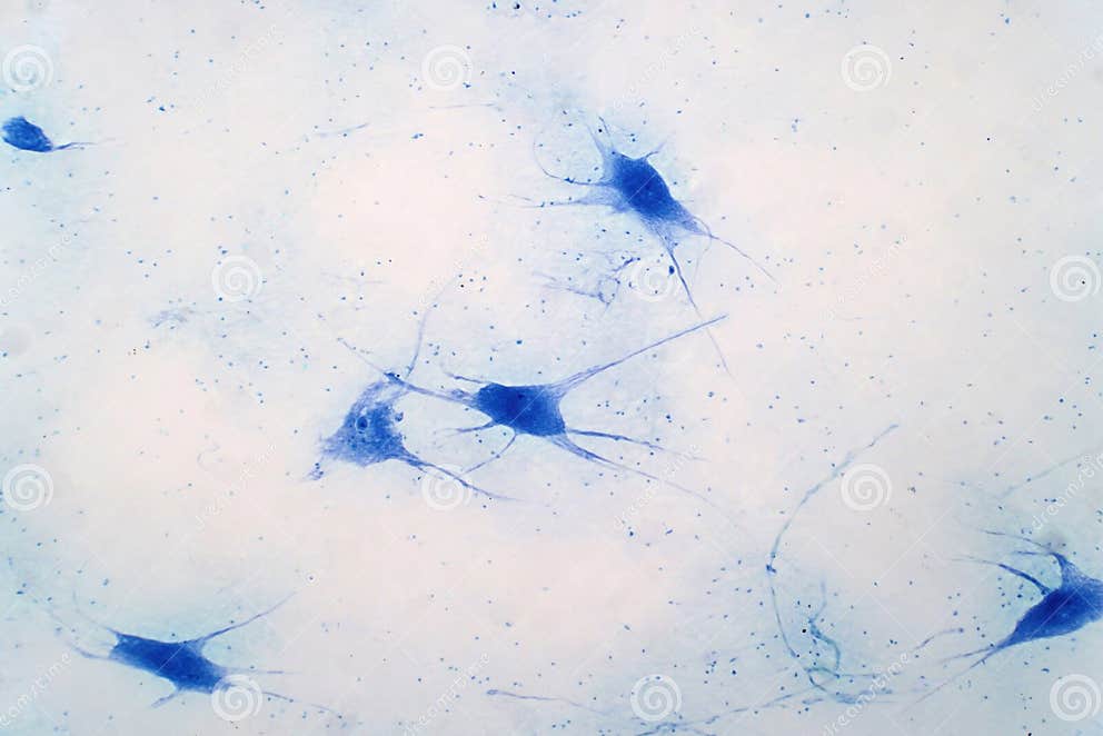 Neurons Cells from the Brain Under the Light Microscope View Stock ...