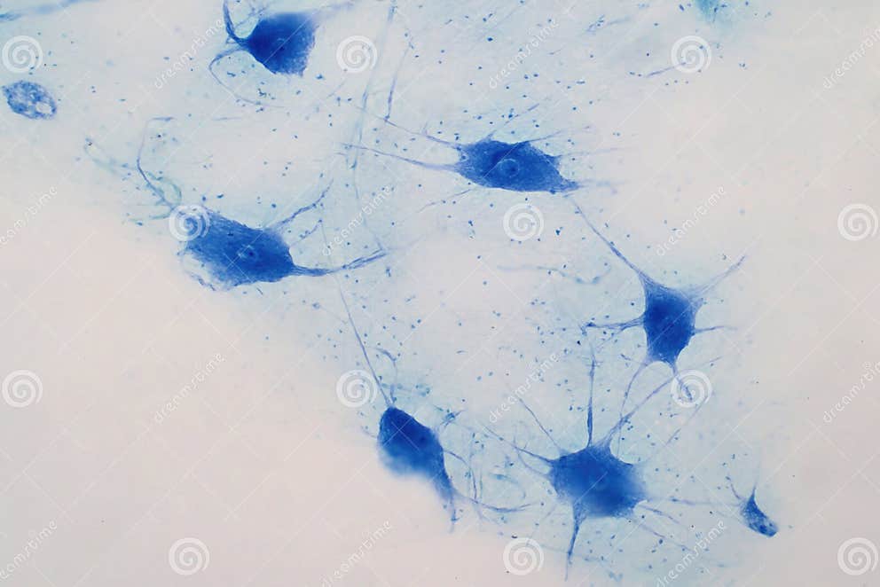 Neurons Cells from the Brain Under the Light Microscope View Stock ...