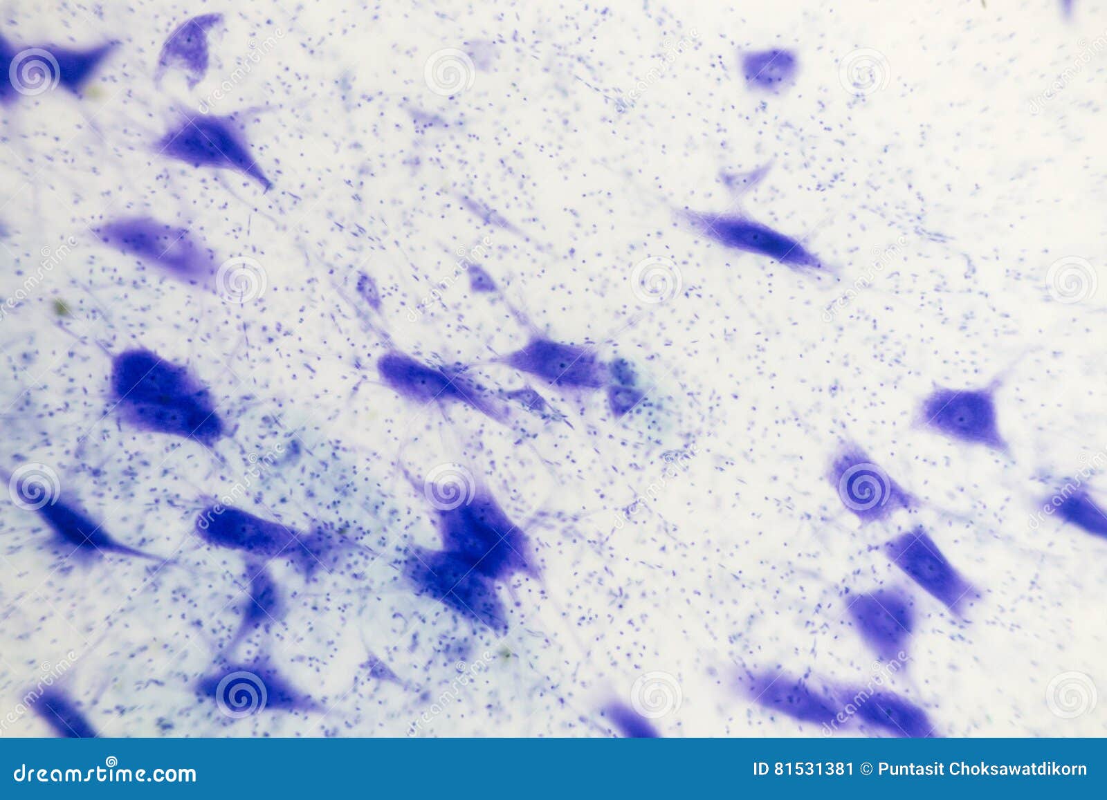 Neurons Cells from the Brain Stock Image - Image of energy, encephalon ...