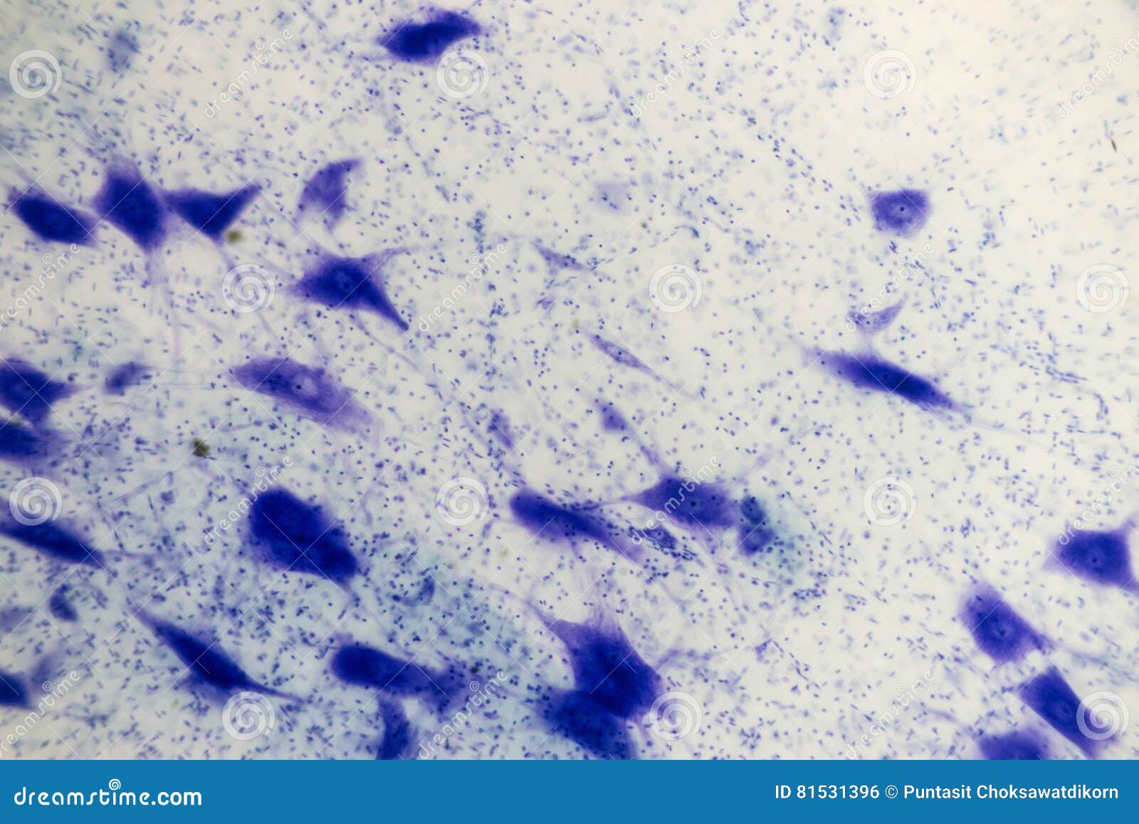 Neurons Cells from the Brain Stock Photo - Image of human, biological ...