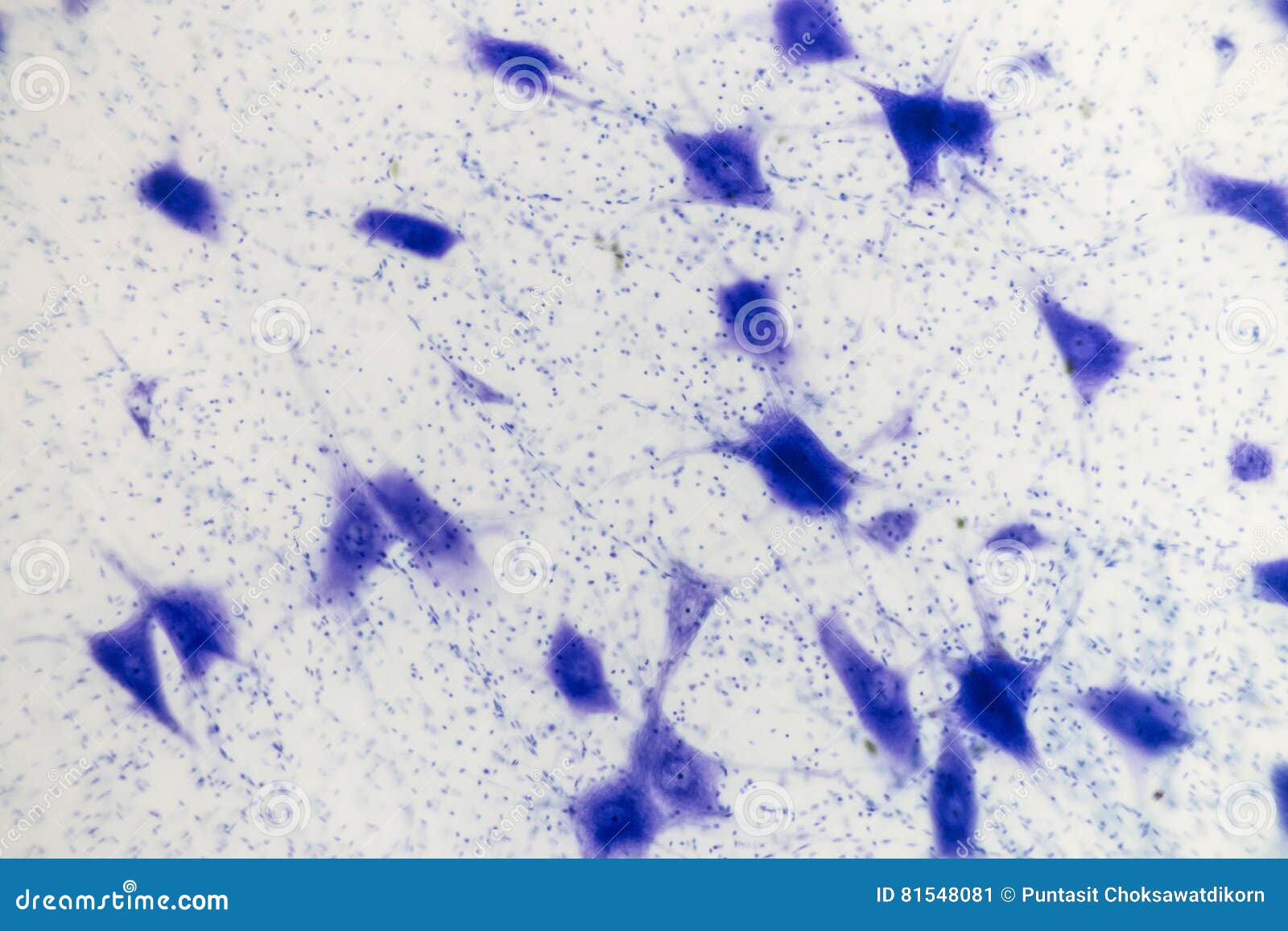 Neurons Cells From The Spinal Cord Under Microscope View. Stock Image ...