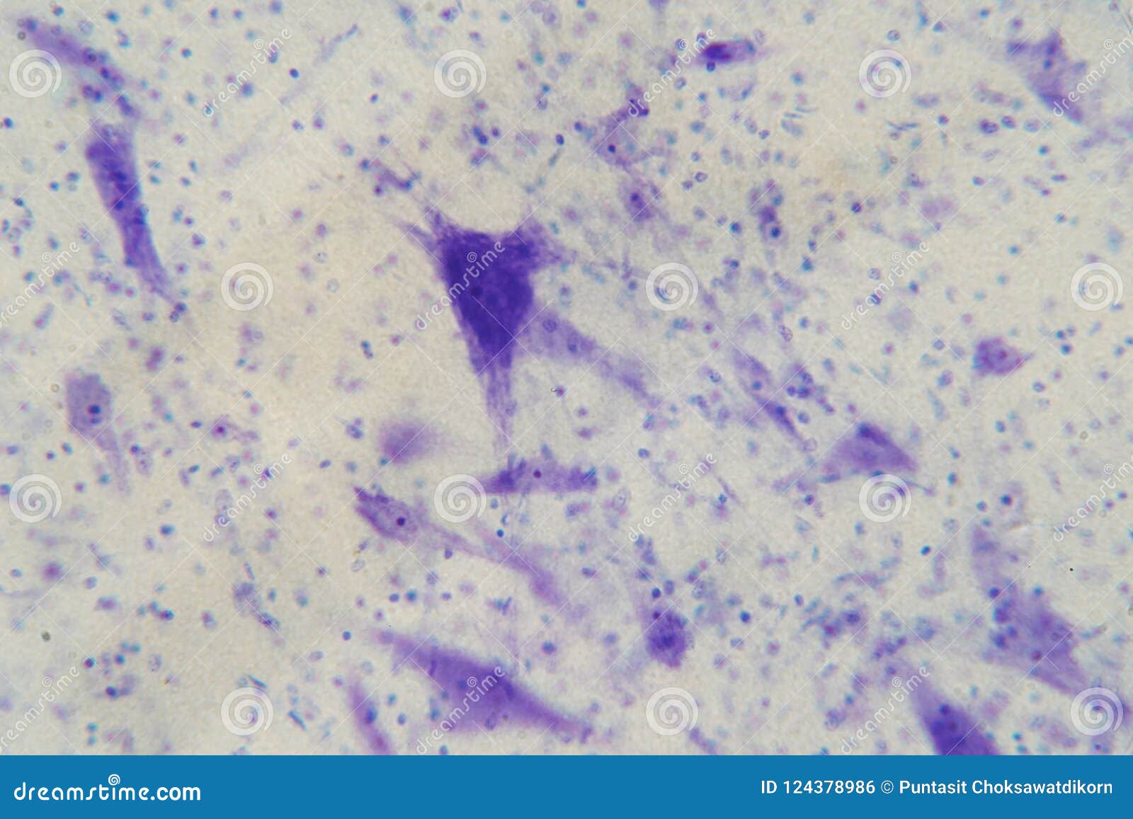 Neurons Cells from the Brain Under the Microscope View Stock Photo ...