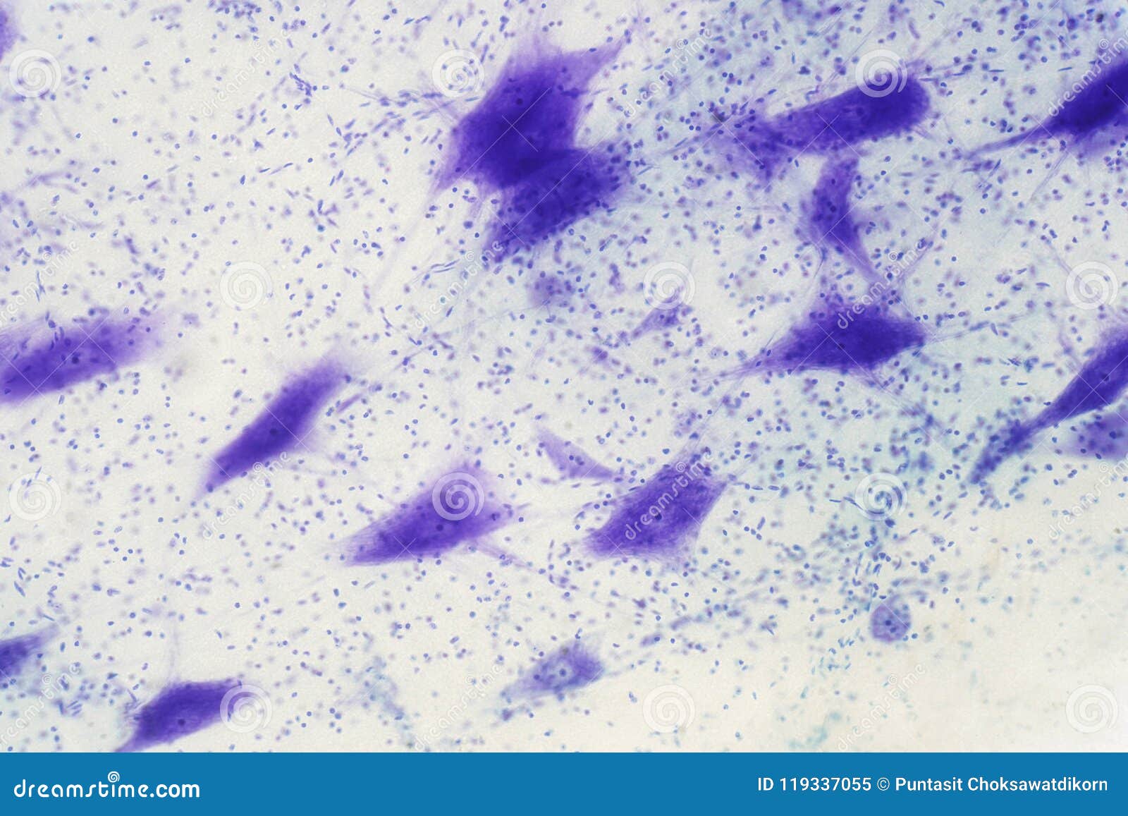 Neurons Cells from the Brain Under the Microscope View Stock Image ...