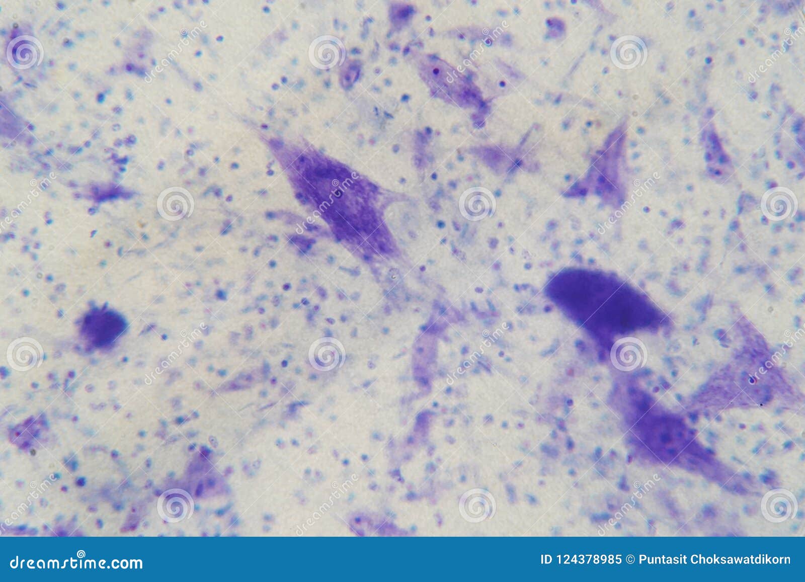 Neurons Cells from the Brain Under the Microscope View Stock Image ...