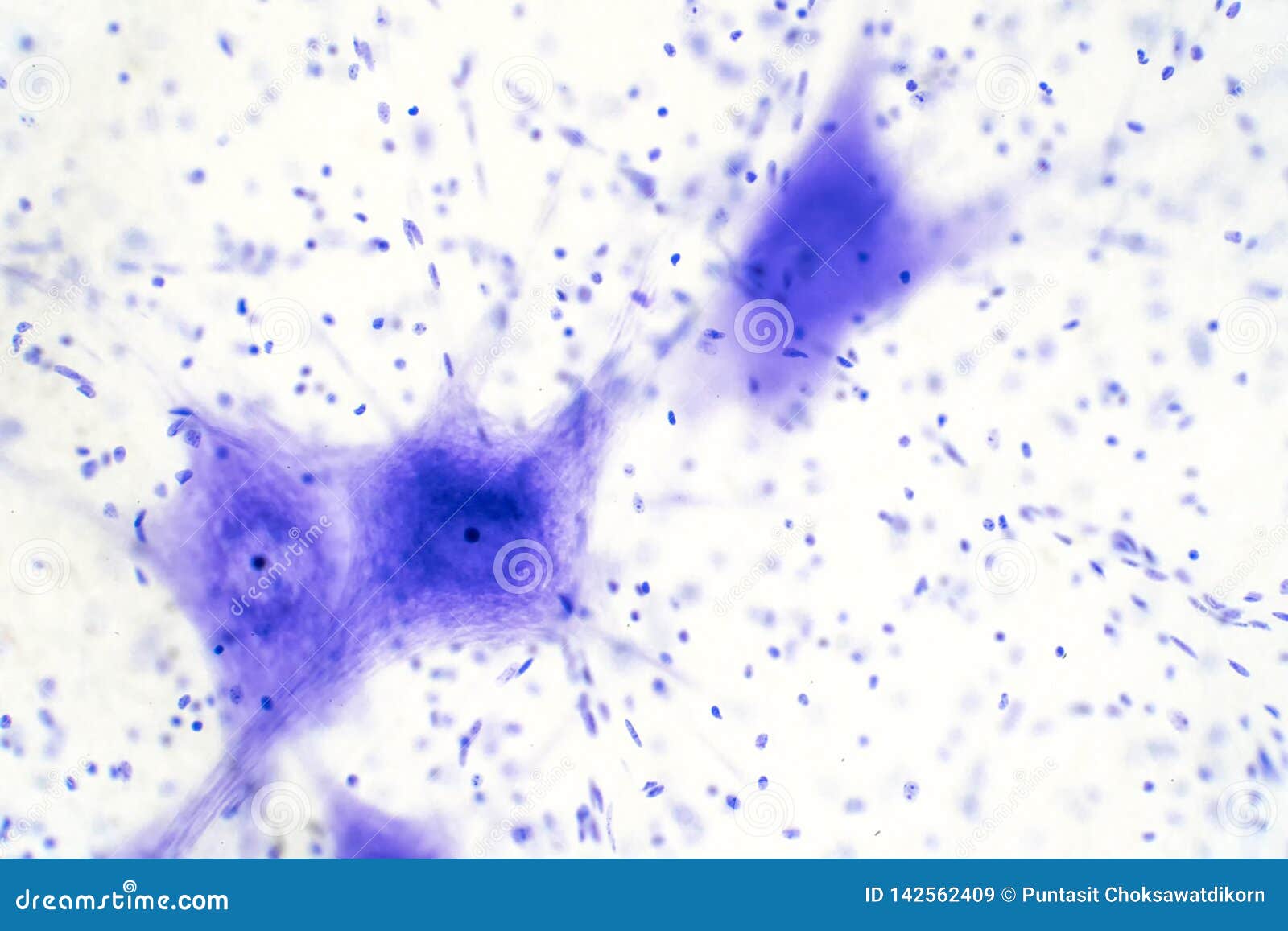 Neurons Cells from the Brain Under the Microscope View Stock Image ...