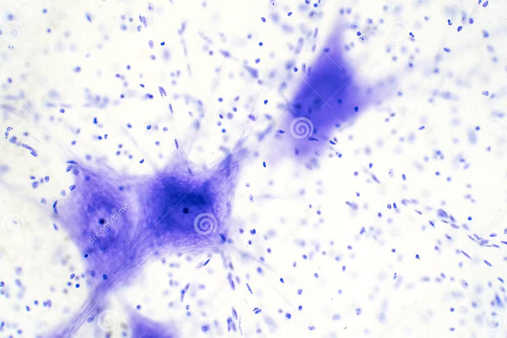 Neurons Cells from the Brain Under the Microscope View Stock Image ...