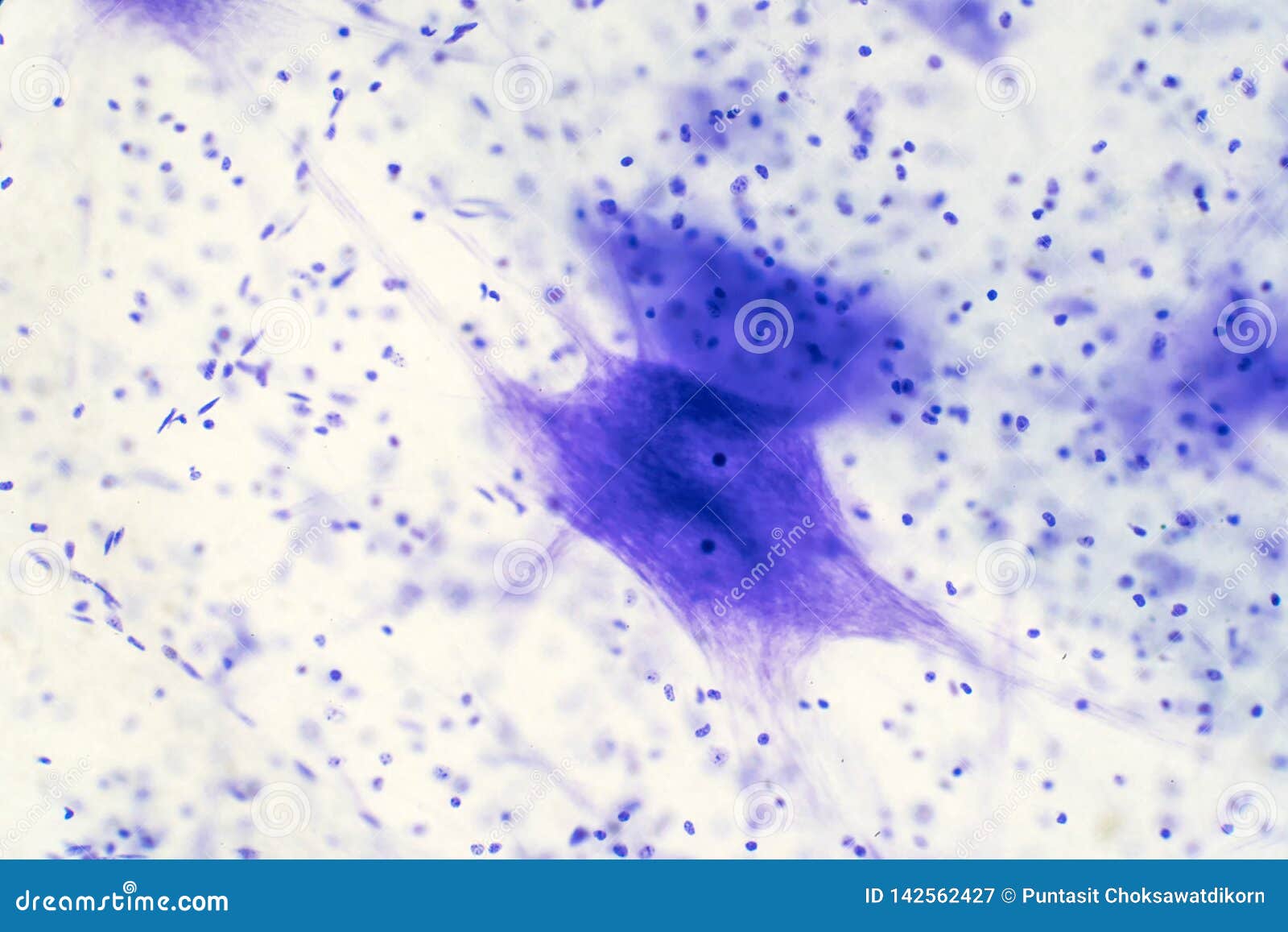 Neurons Cells from the Brain Under the Microscope View Stock Image ...