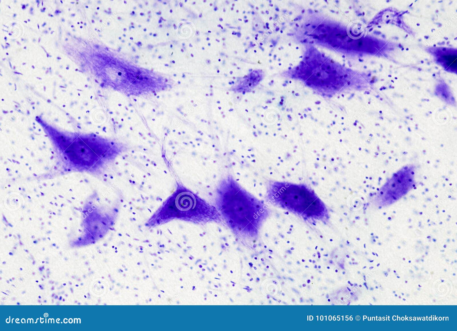Neurons Cells from the Brain Under Microscope View Stock Photo - Image ...