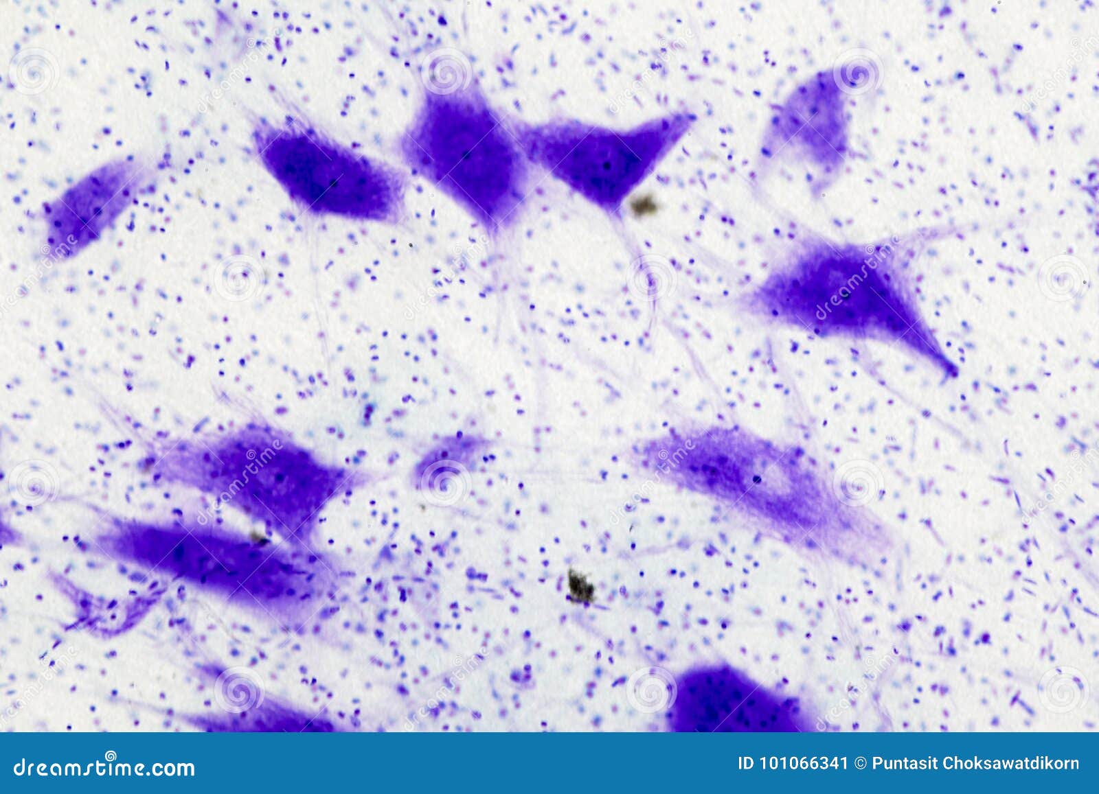 Human Nerve Cells Under Microscope