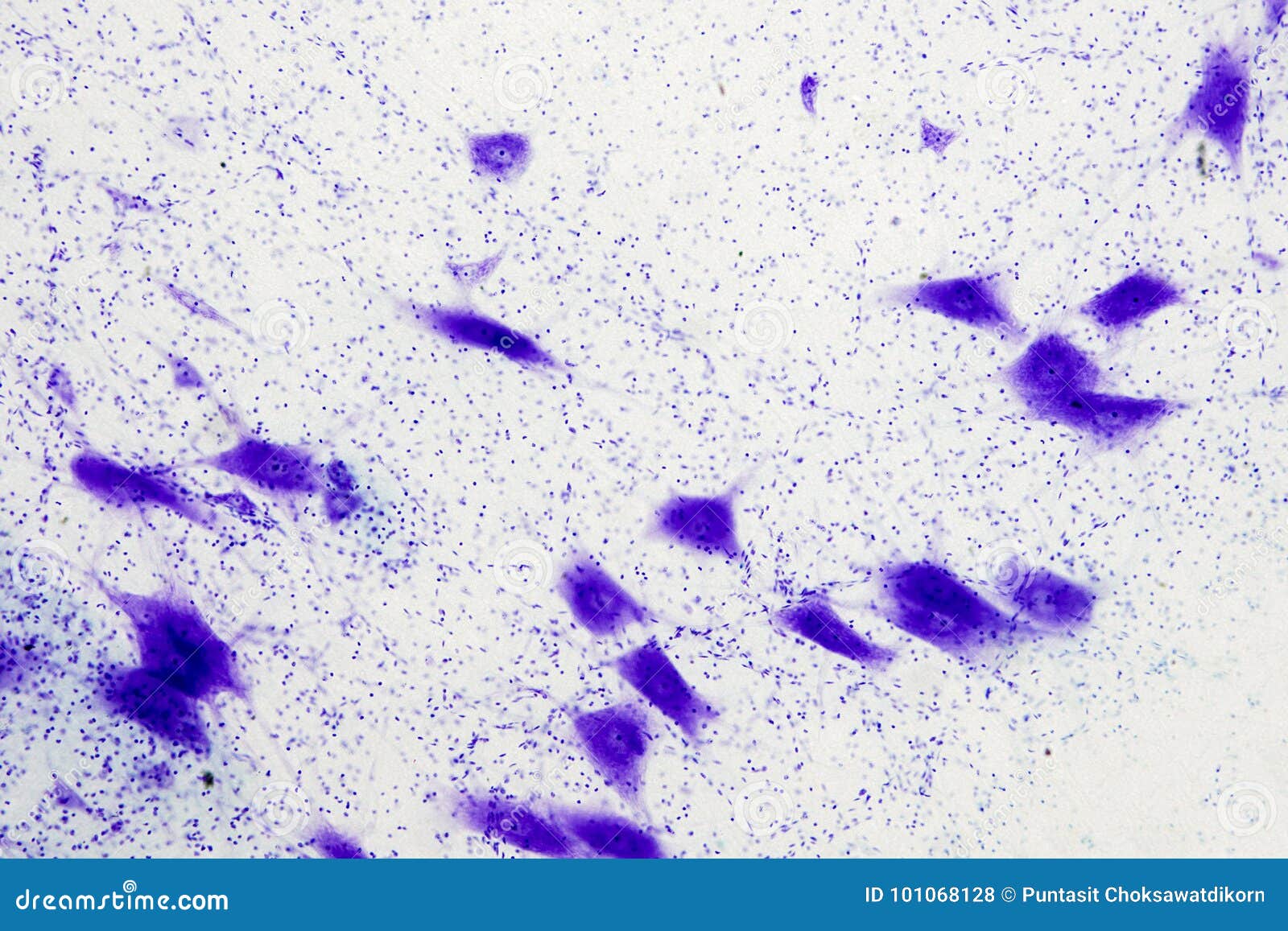 Neurons Cells from the Brain Under Microscope View Stock Photo - Image ... Neurons Cells from the Brain Under Microscope View Stock Photo - Image ...