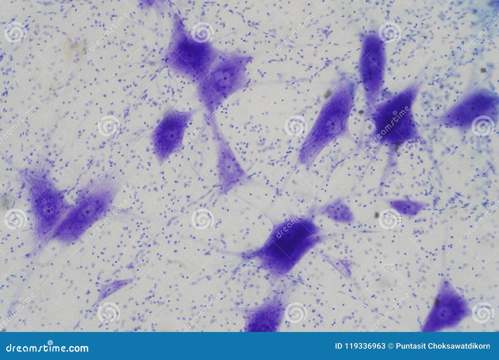Neurons Cells from the Brain Under the Microscope View Stock Image ...