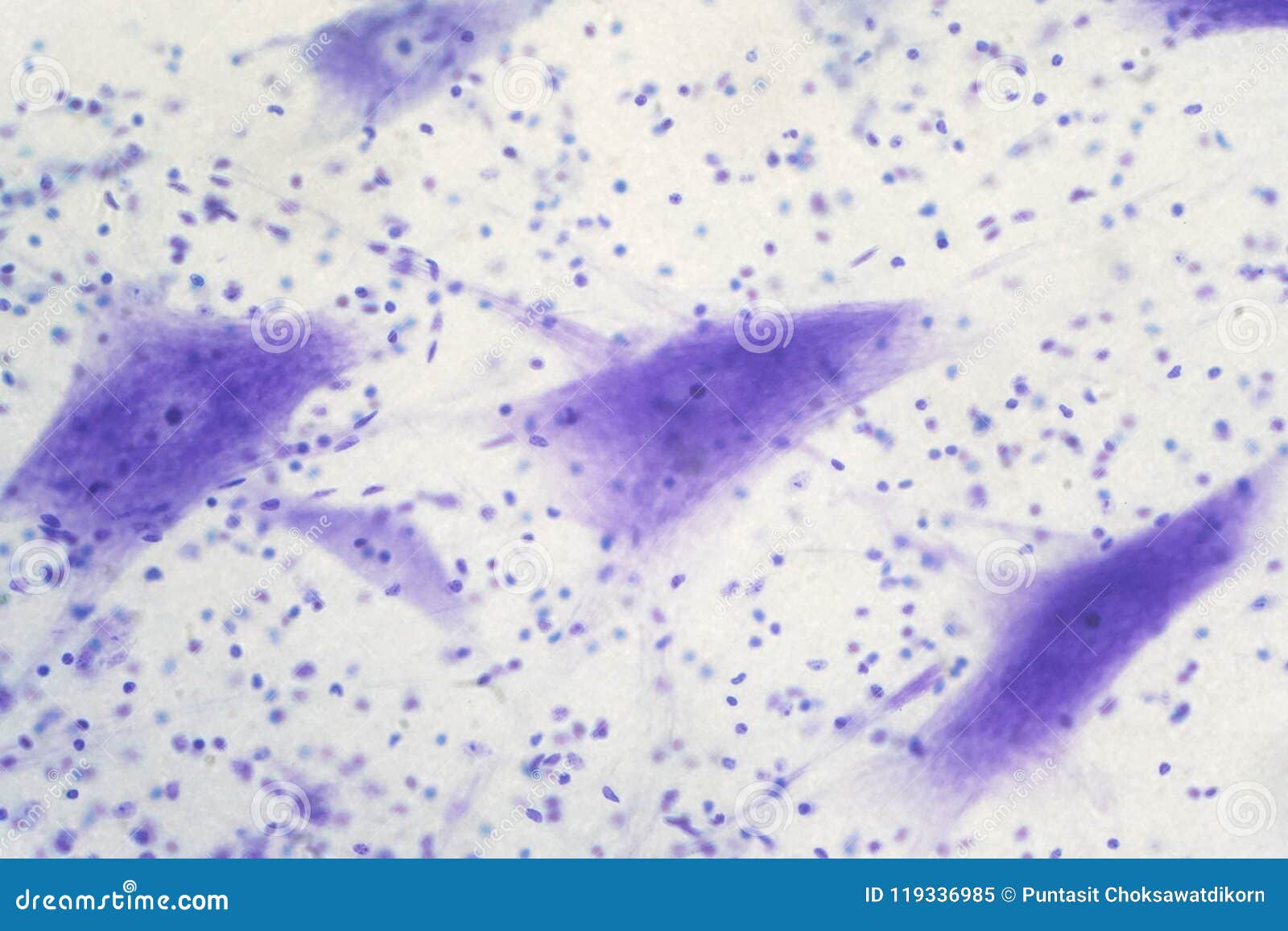 Neurons Cells from the Brain Under the Microscope View. Stock Image ...