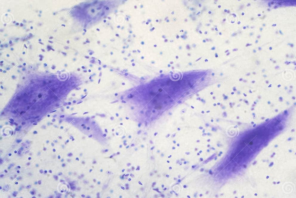 Neurons Cells from the Brain Under the Microscope View. Stock Image ...