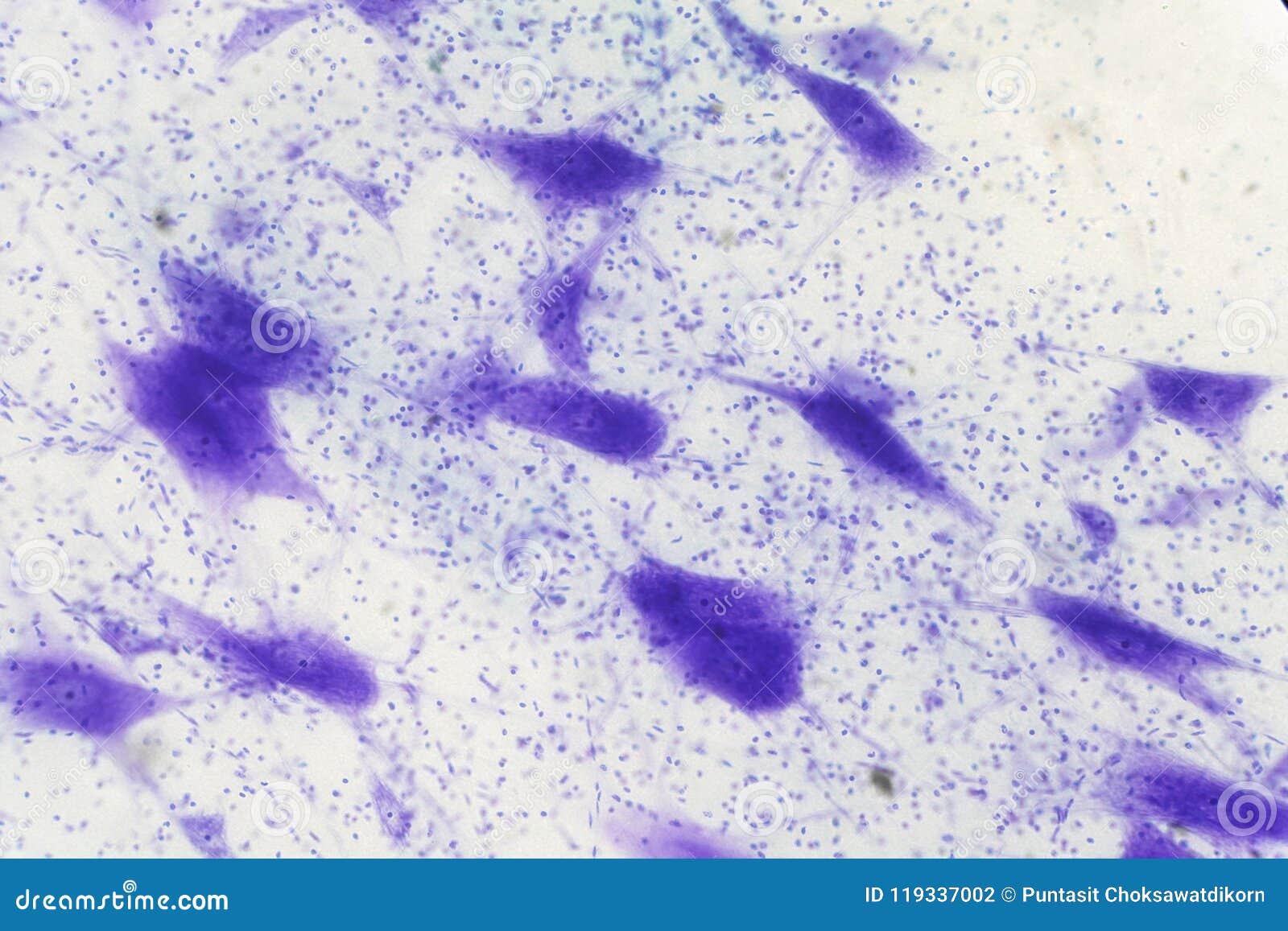 Neurons Cells from the Brain Under the Microscope View Stock Photo ...