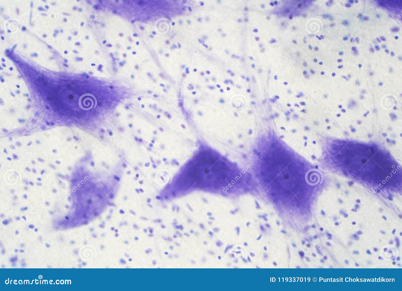 Neurons Cells from the Brain Under the Microscope View. Stock Image ... Neurons Cells from the Brain Under the Microscope View. Stock Image ...
