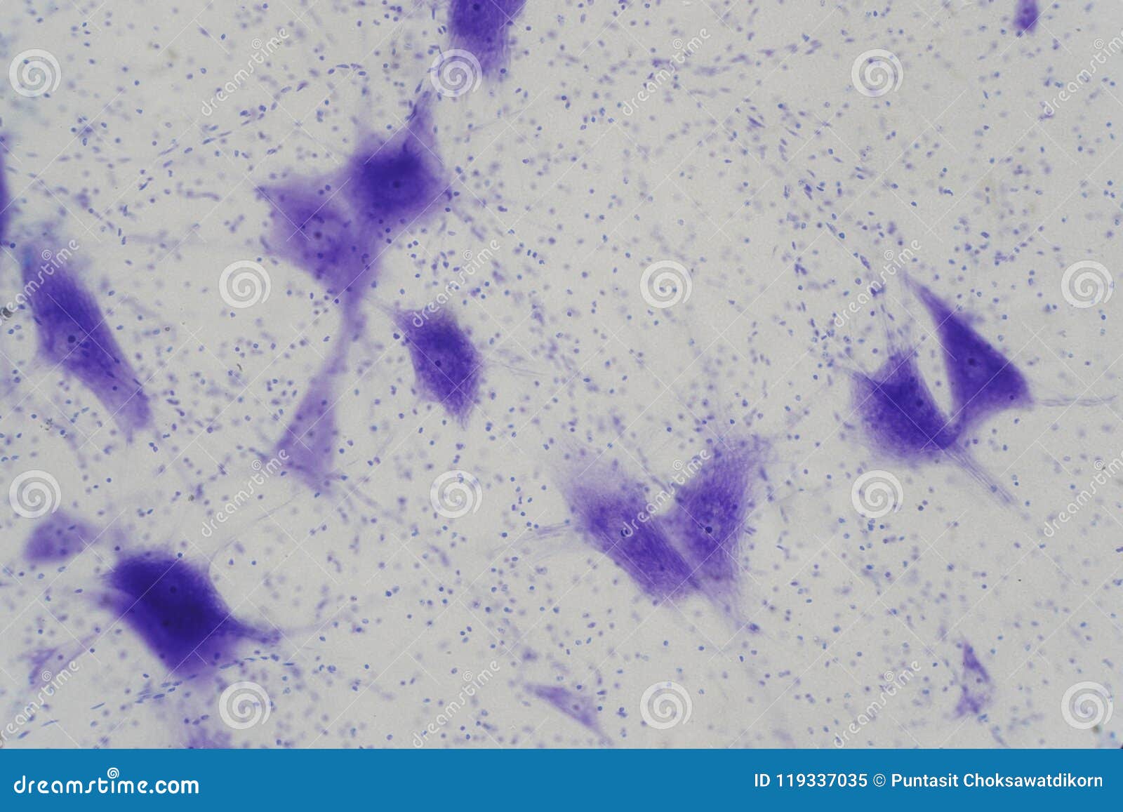 Neurons Cells from the Brain Under the Microscope View. Stock Image ...