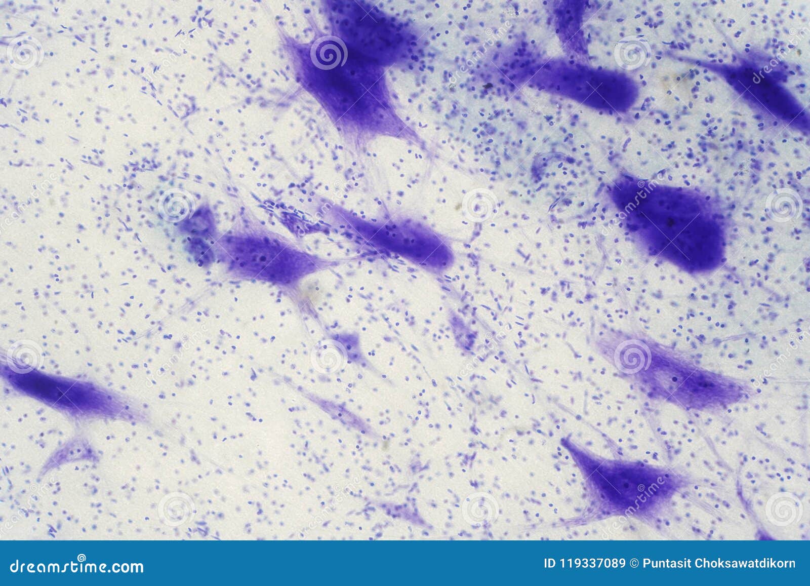 Neurons Cells from the Brain Under the Microscope View Stock Image ...